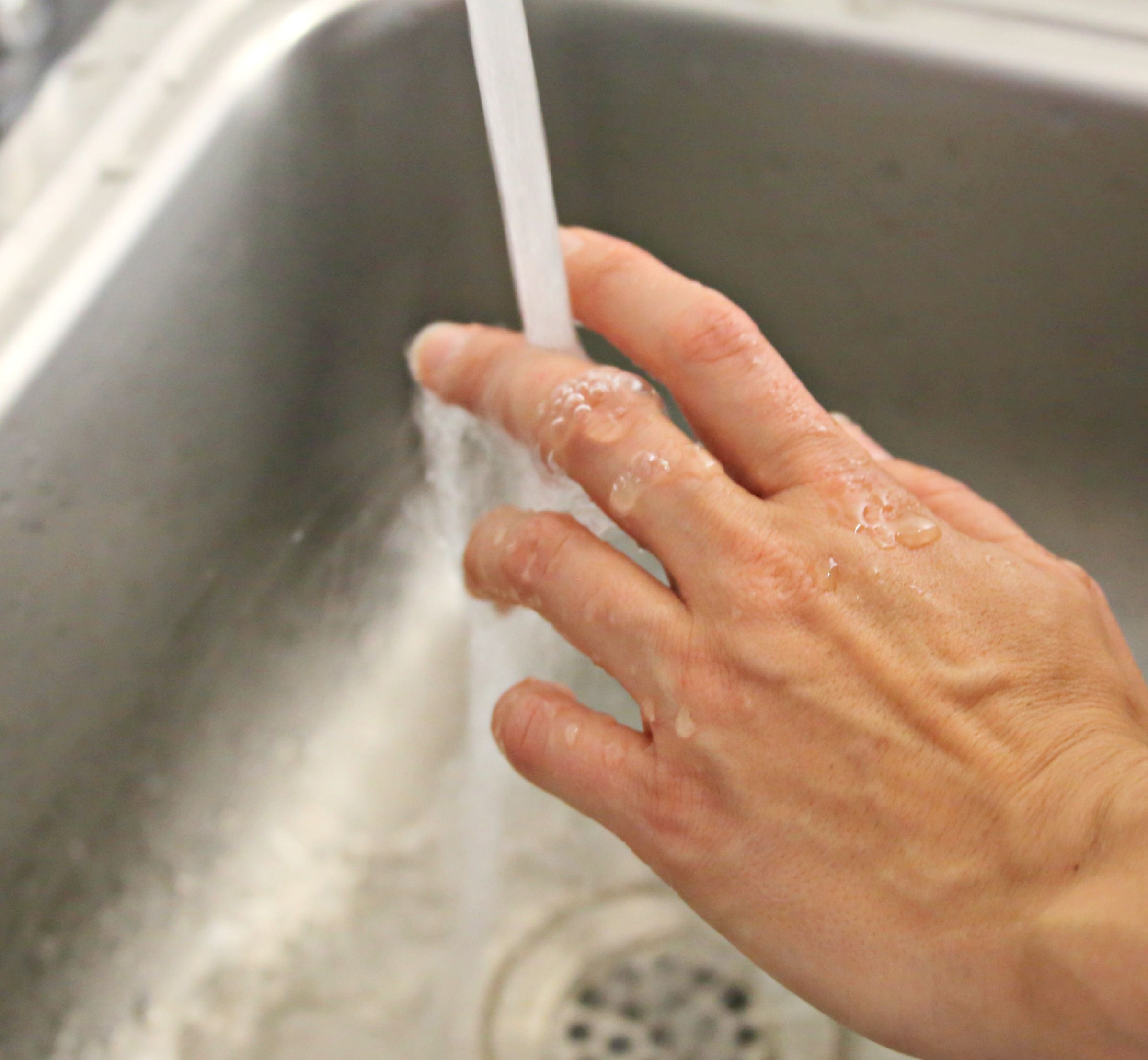 Disinfect a Cut : 4 Steps (with Pictures) - Instructables