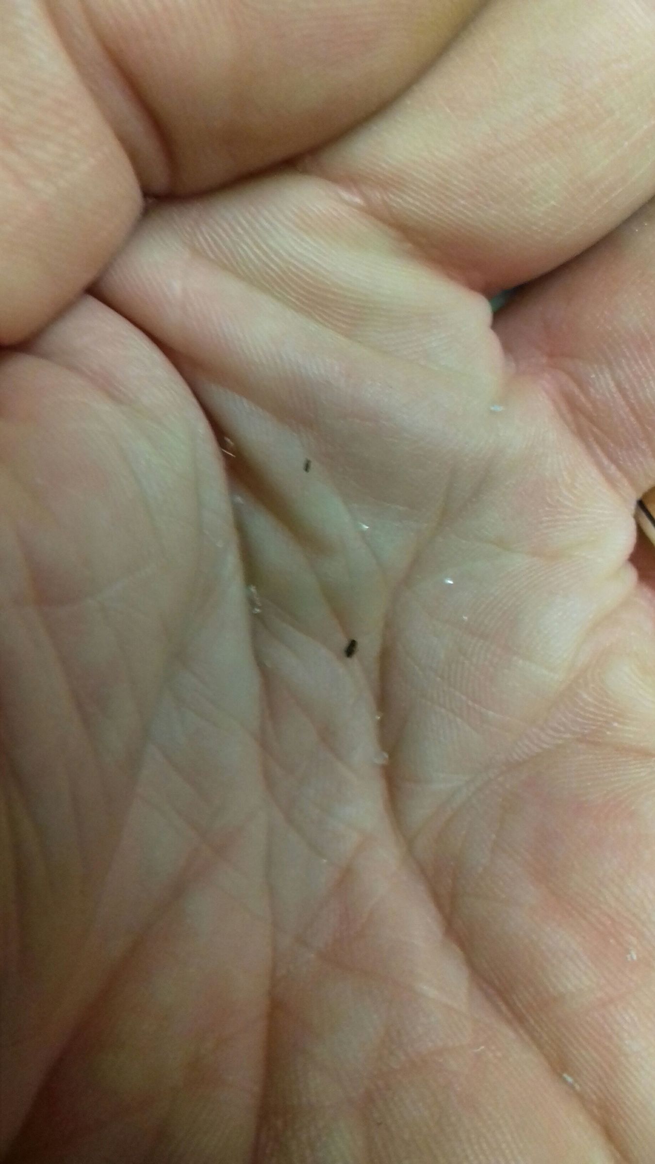Cuts On Skin From Glass