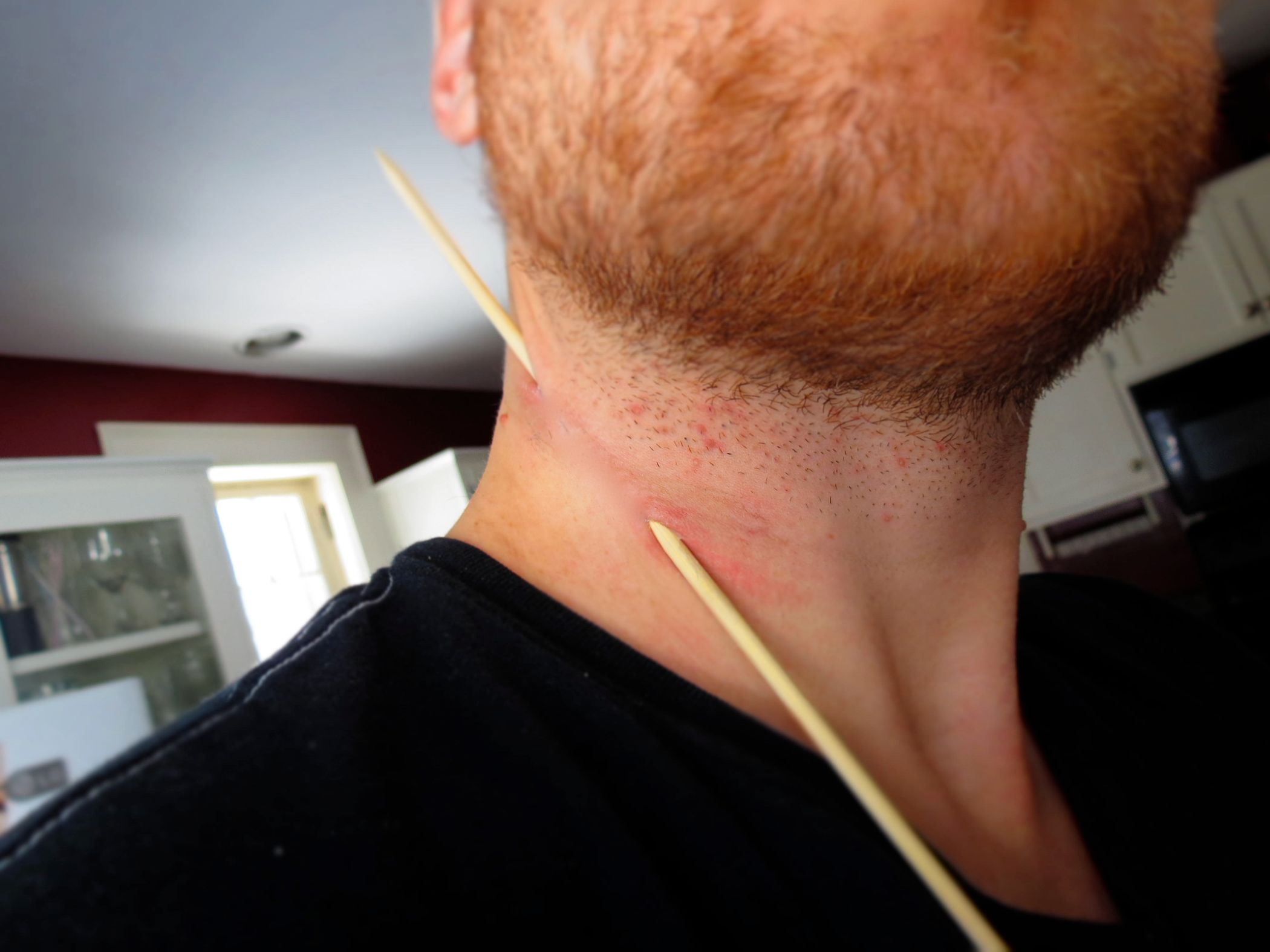 Skewered Zombie Injury (with Pictures) - Instructables