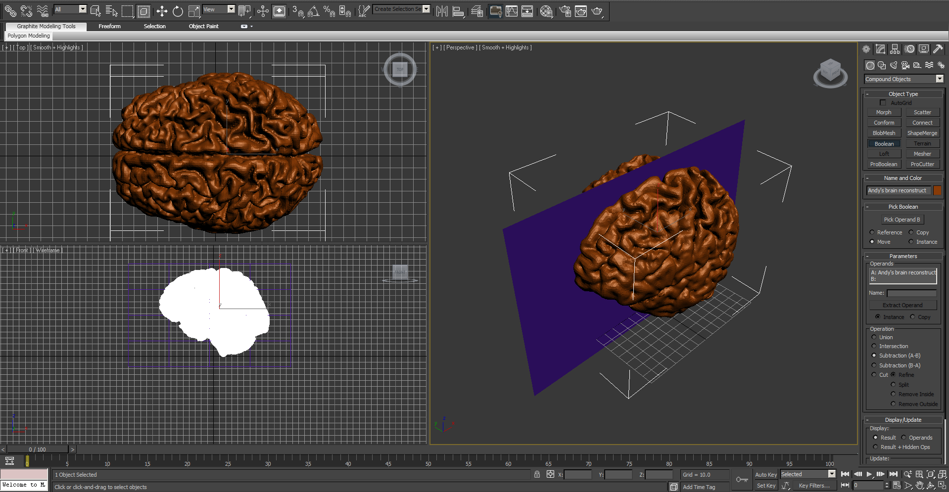 Edible Chocolate Brain From MRI Scan : 9 Steps (with Pictures ...