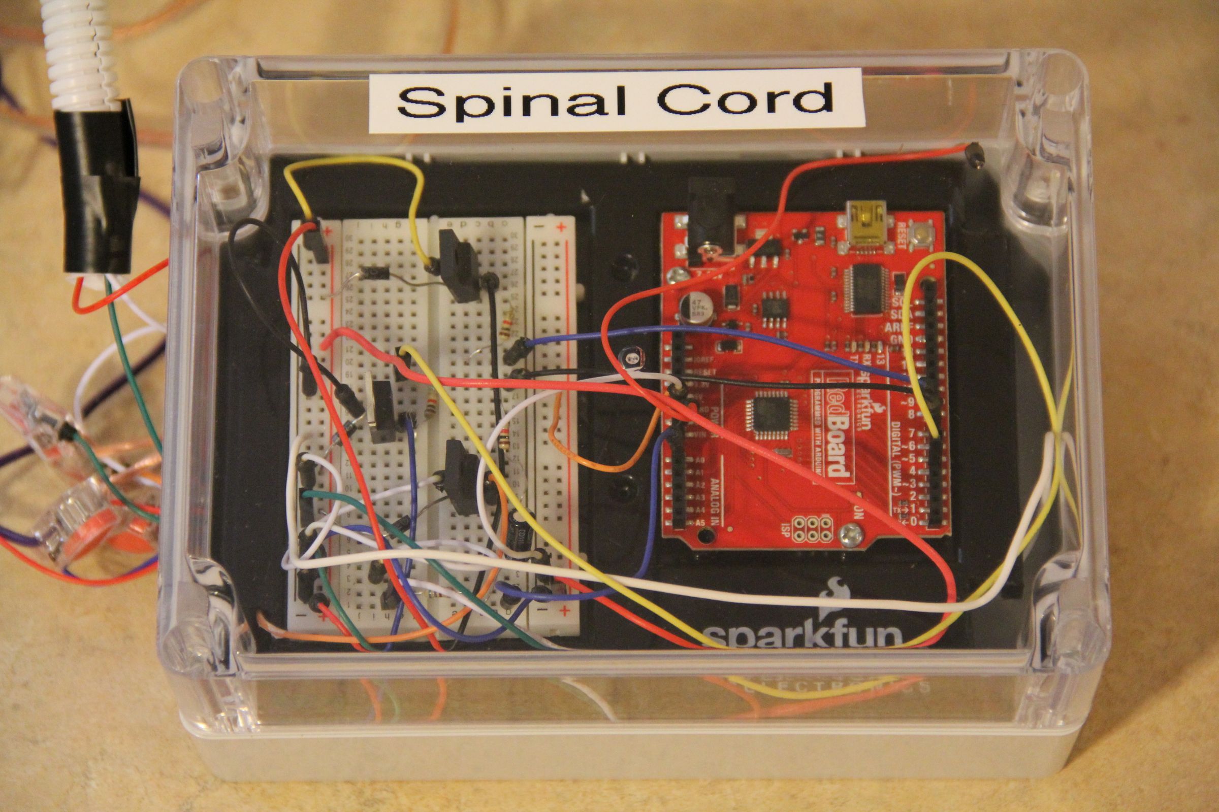 Arduino Mechanotronic Human Pain Reflex : 6 Steps (with Pictures ...