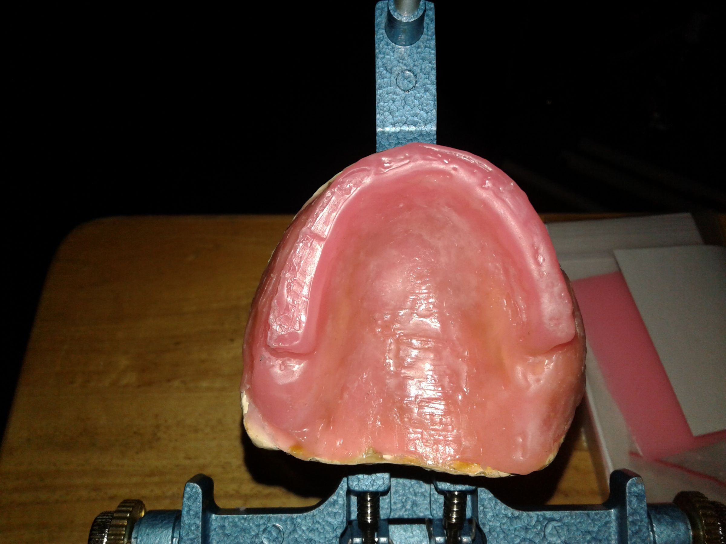 DIY Dentures : a Post-Surgical Plan : 12 Steps (with Pictures ...