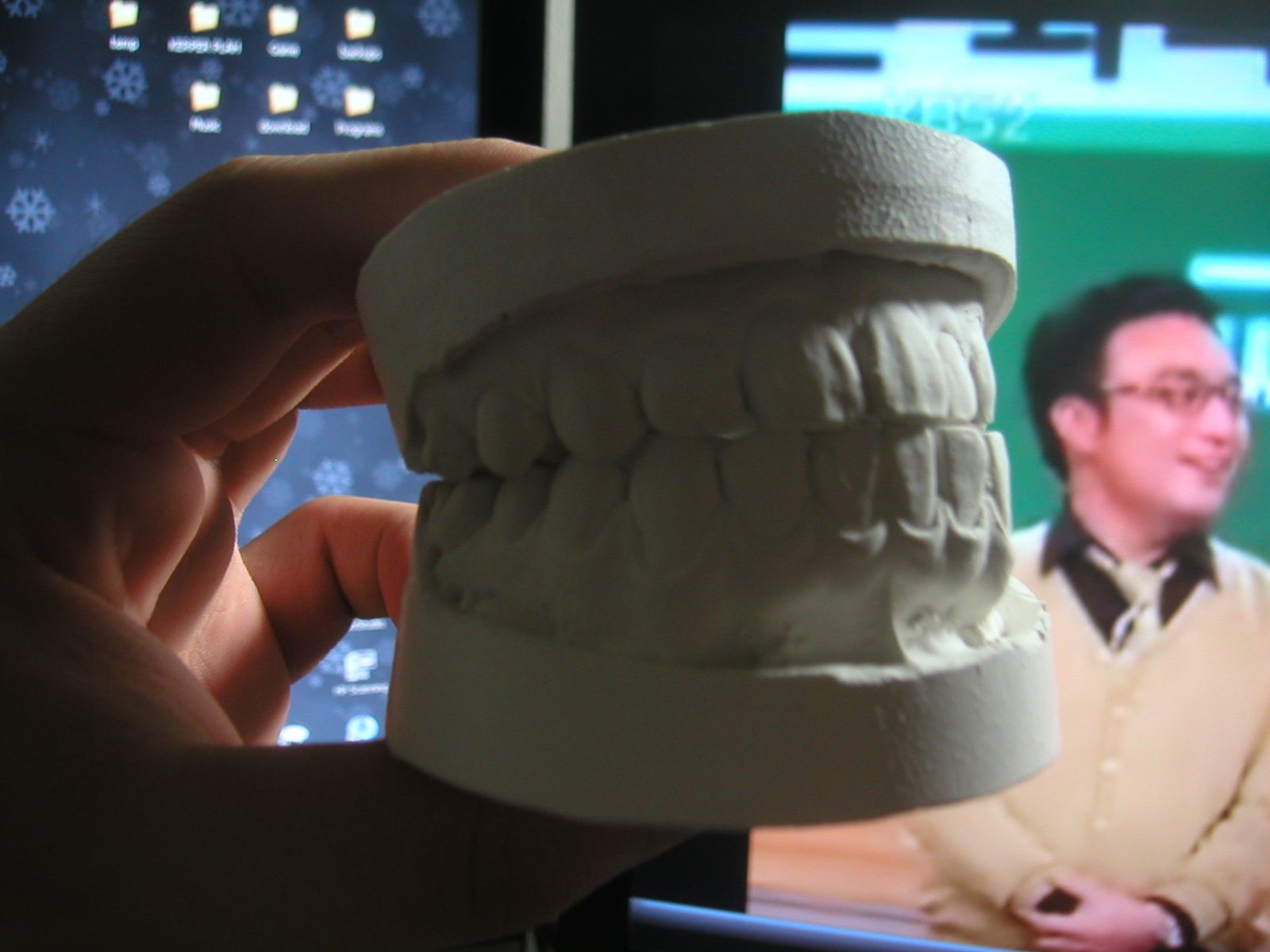 Make Teeth Mold for Halloween Teeth : 4 Steps (with Pictures ...