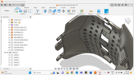 3D Printed Back Brace for Scoliosis : 7 Steps (with Pictures ...