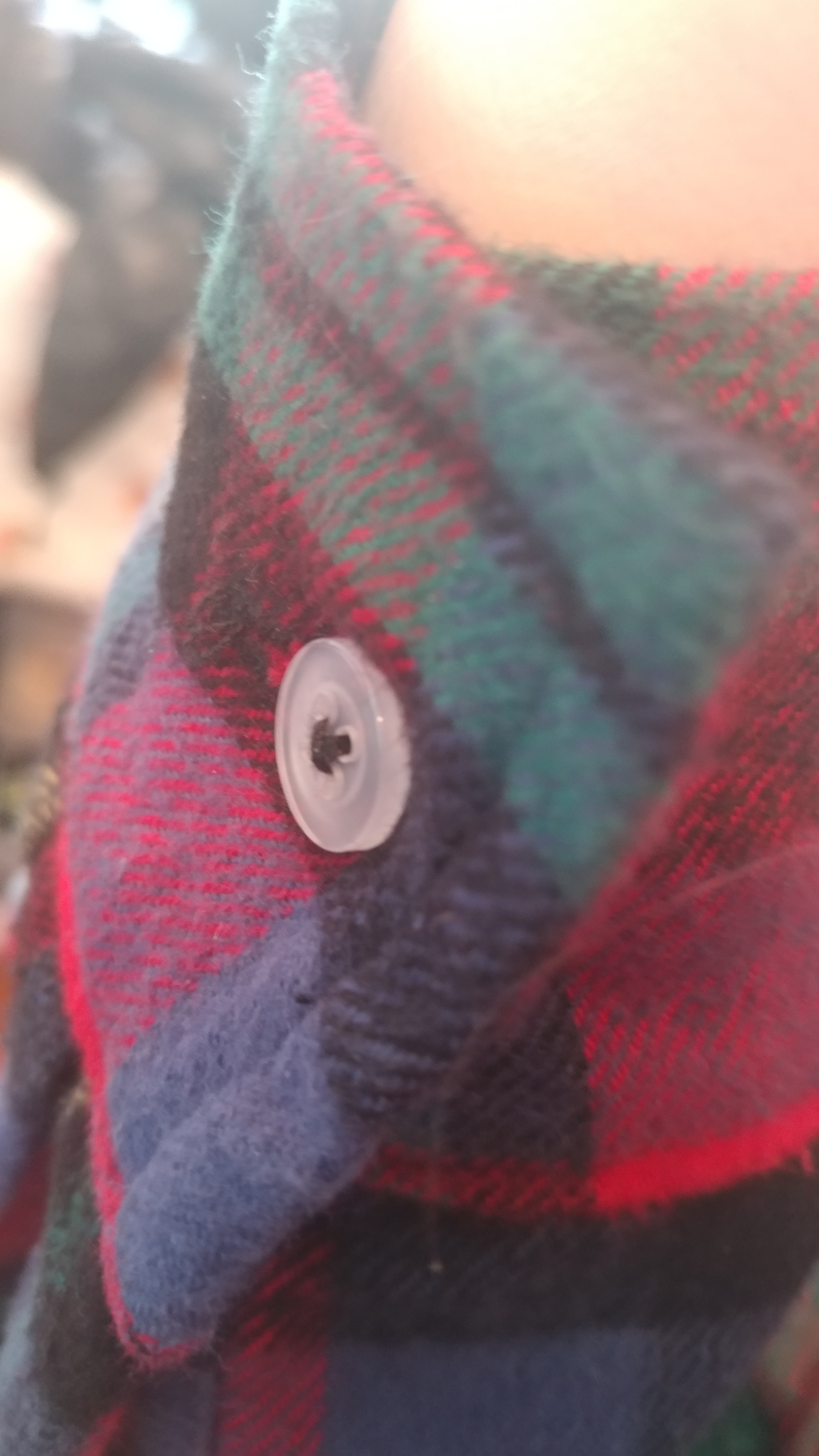 DIY Button Repair : 6 Steps (with Pictures) - Instructables