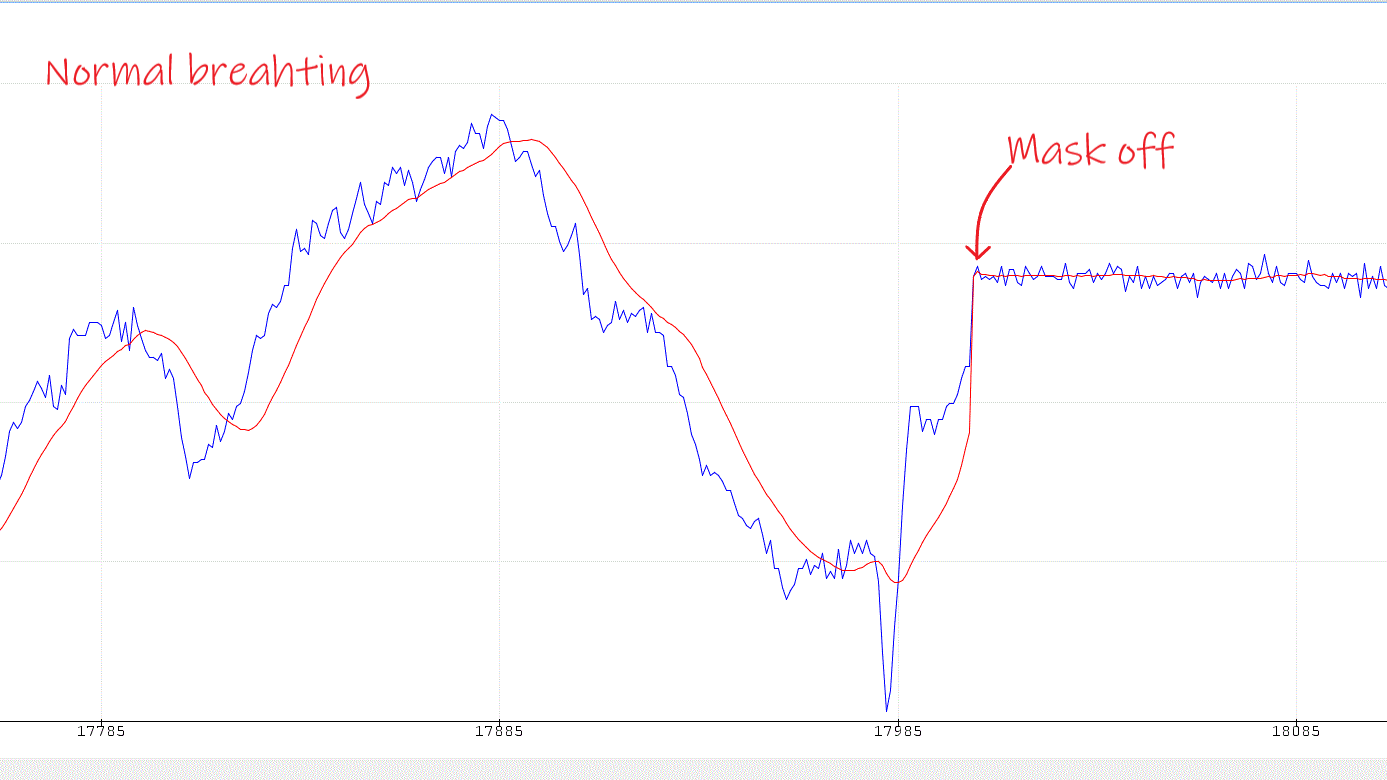 Digital Manometer/CPAP Machine Monitor : 6 Steps (with Pictures ...
