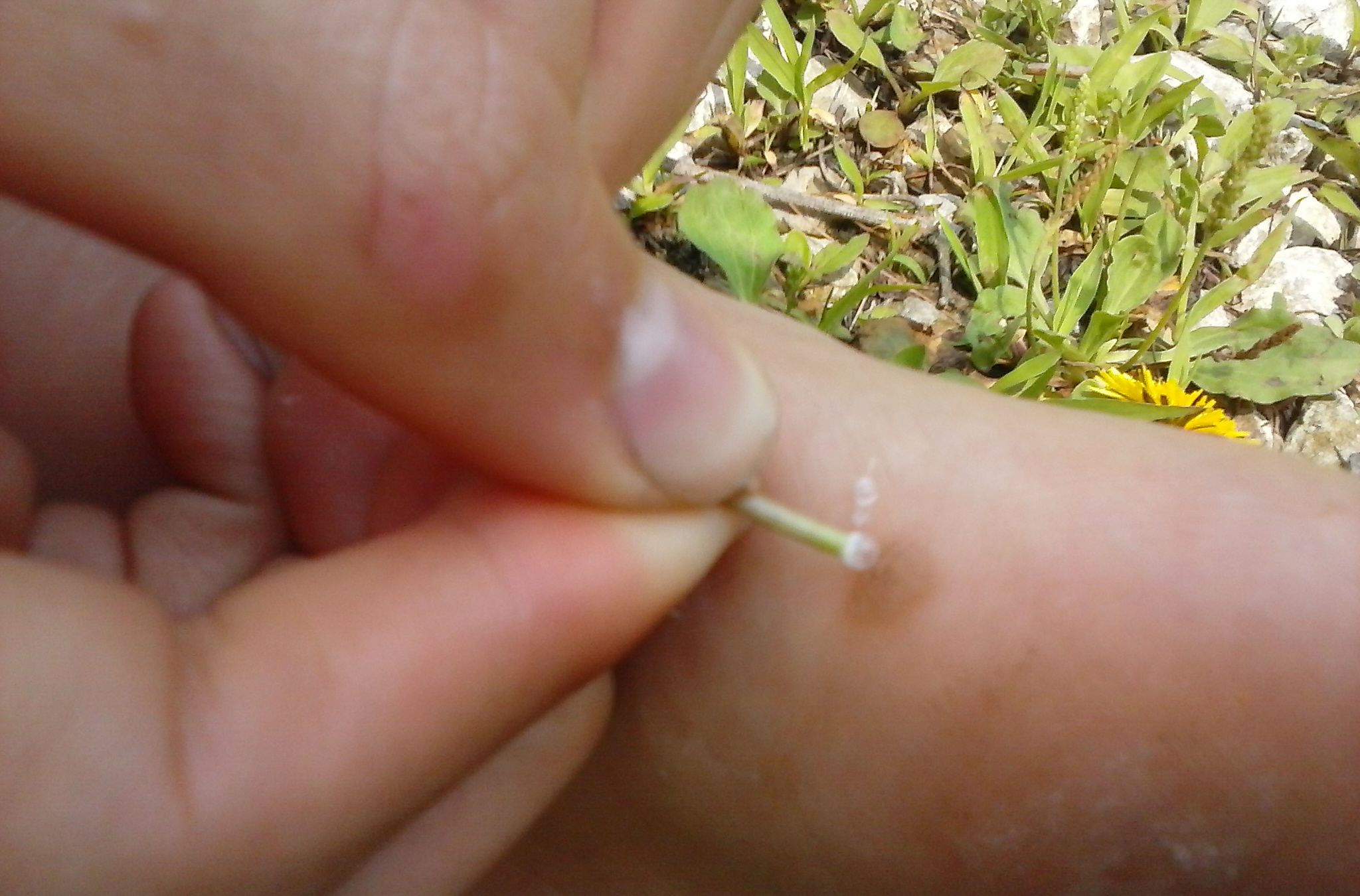 How to Get Rid of Warts : 3 Steps (with Pictures) - Instructables