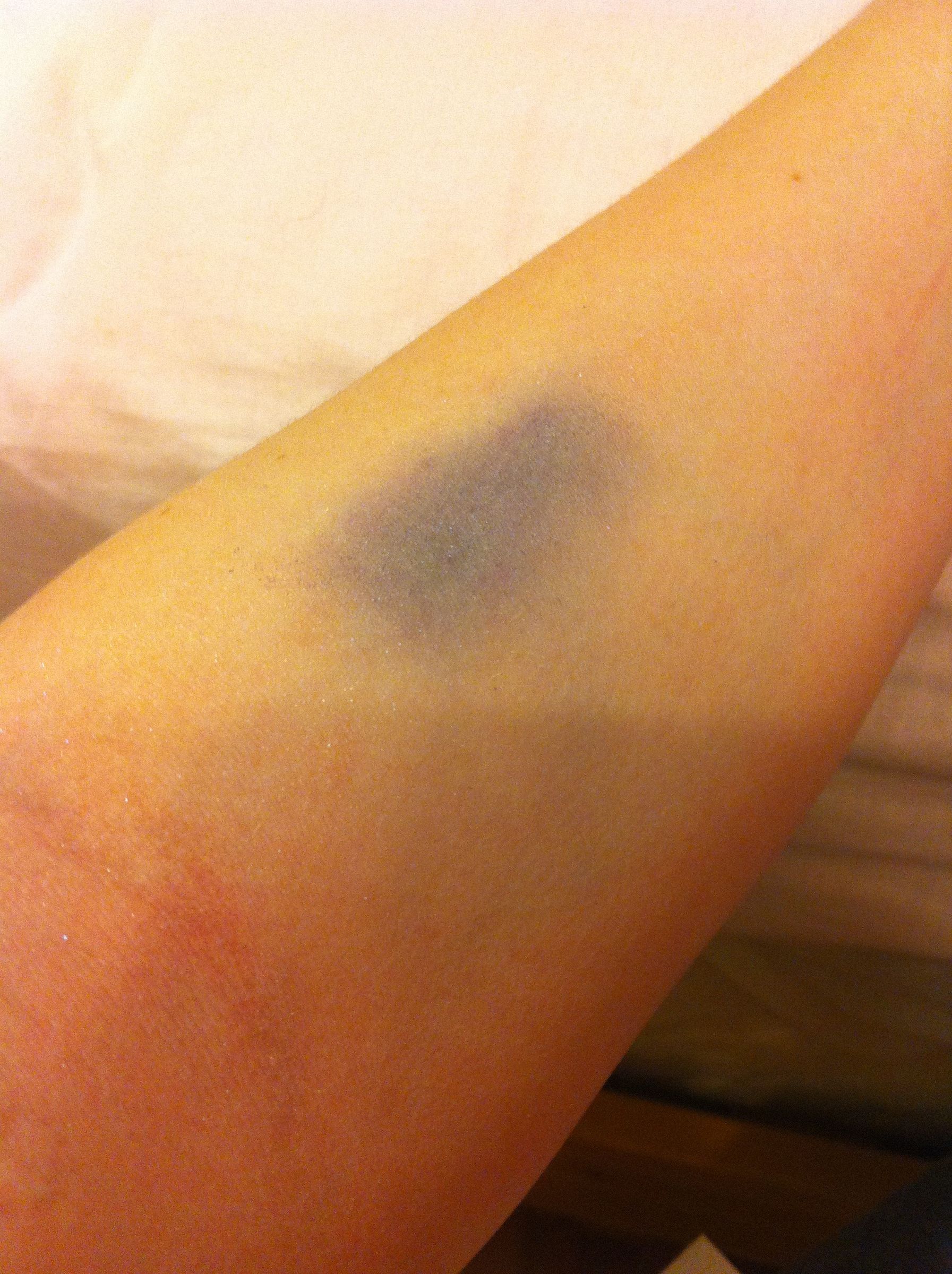 How to Create a Fake Bruise : 6 Steps - Instructables
