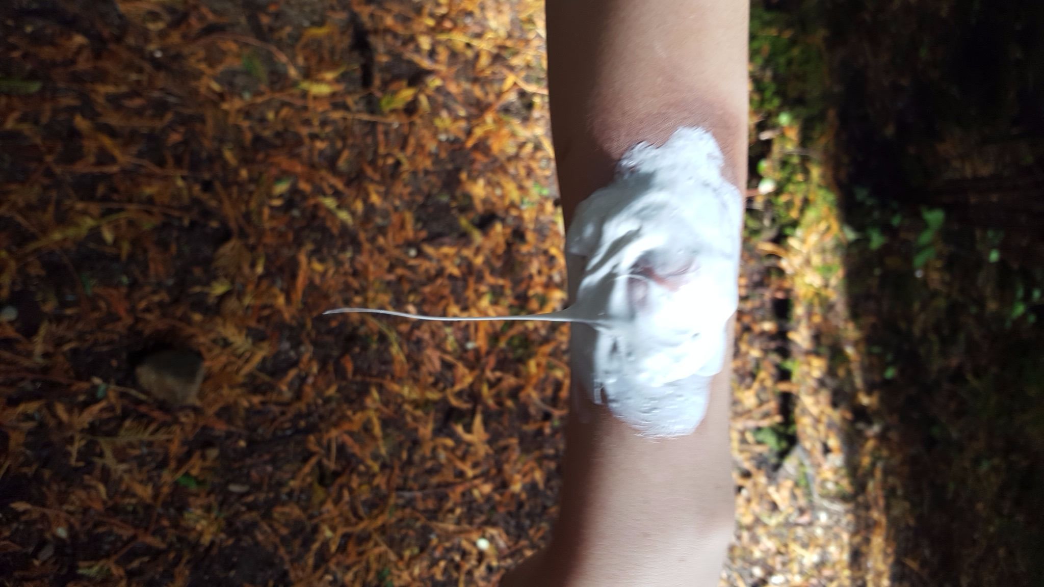Toothpaste Bug Bite Removal : 3 Steps - Instructables