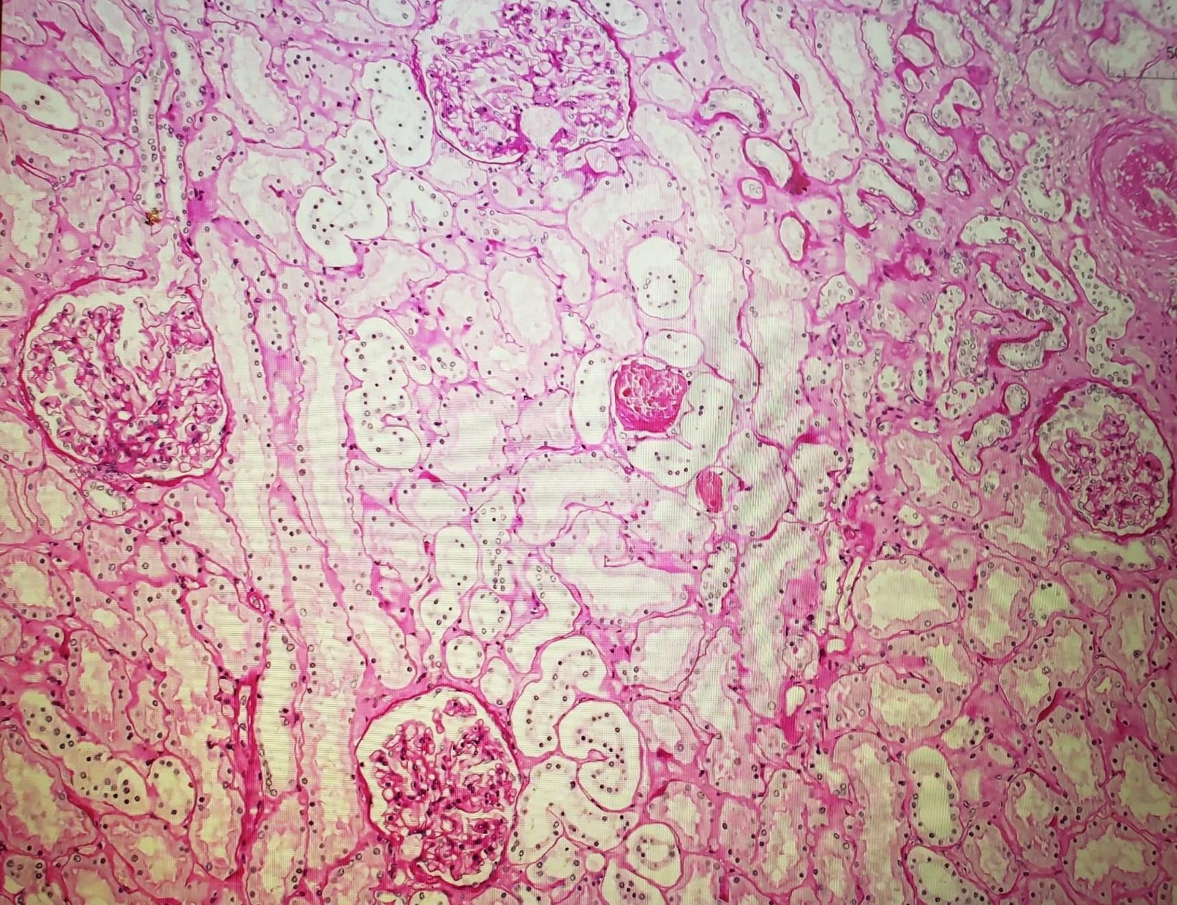 How to Change a Leica and Thermo Stainer : 25 Steps - Instructables