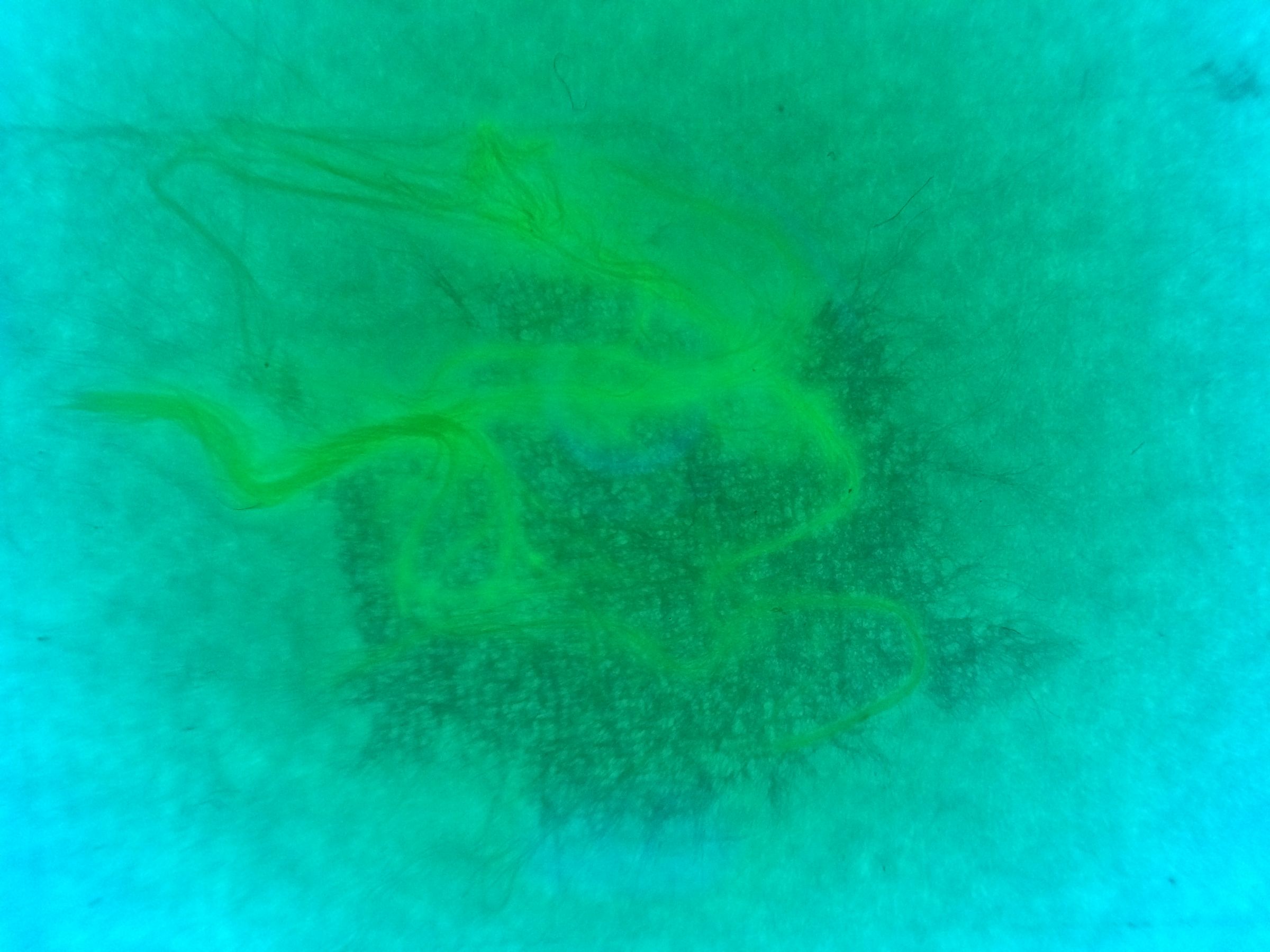 Low-cost Fluorescence and Brightfield Microscopes : 9 Steps (with ...