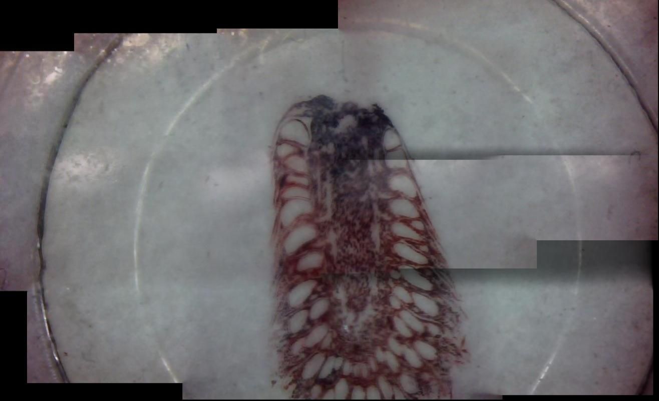 Low Cost Digital Microscope With Automated Slide Movement : 5 Steps ...