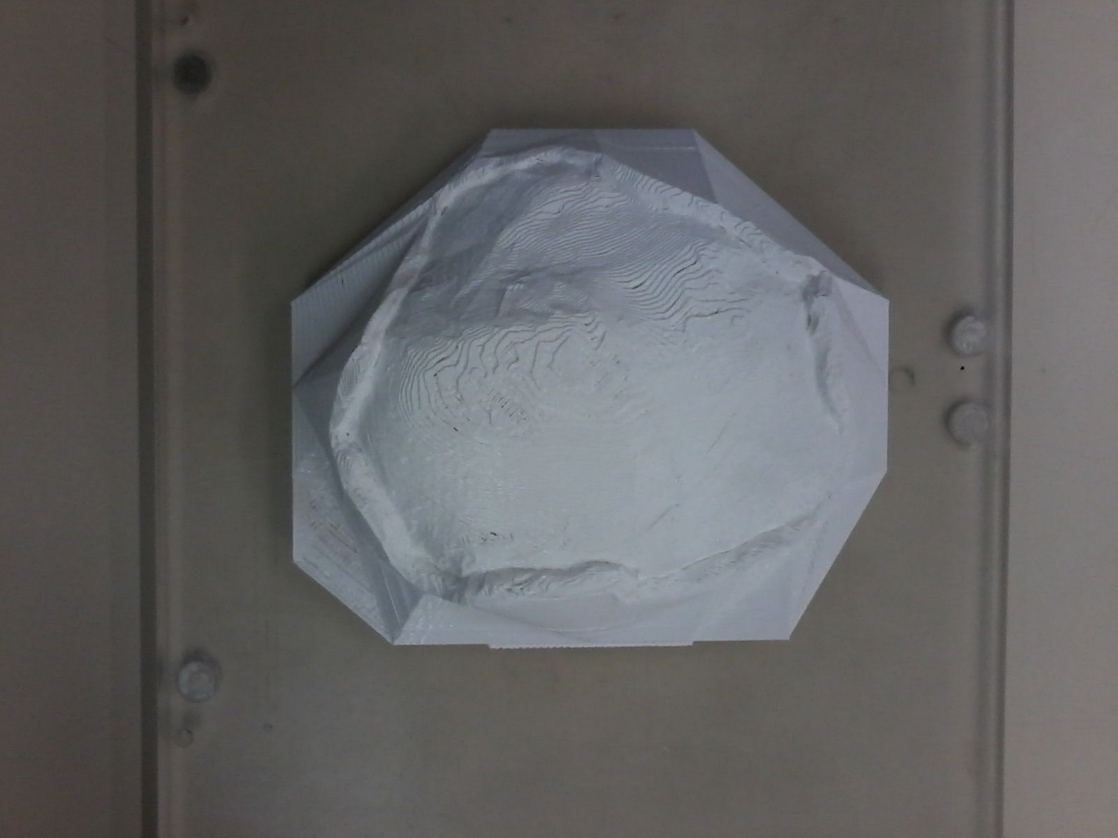 Surgery + Fully 3D Printed Mold : 7 Steps (with Pictures) - Instructables