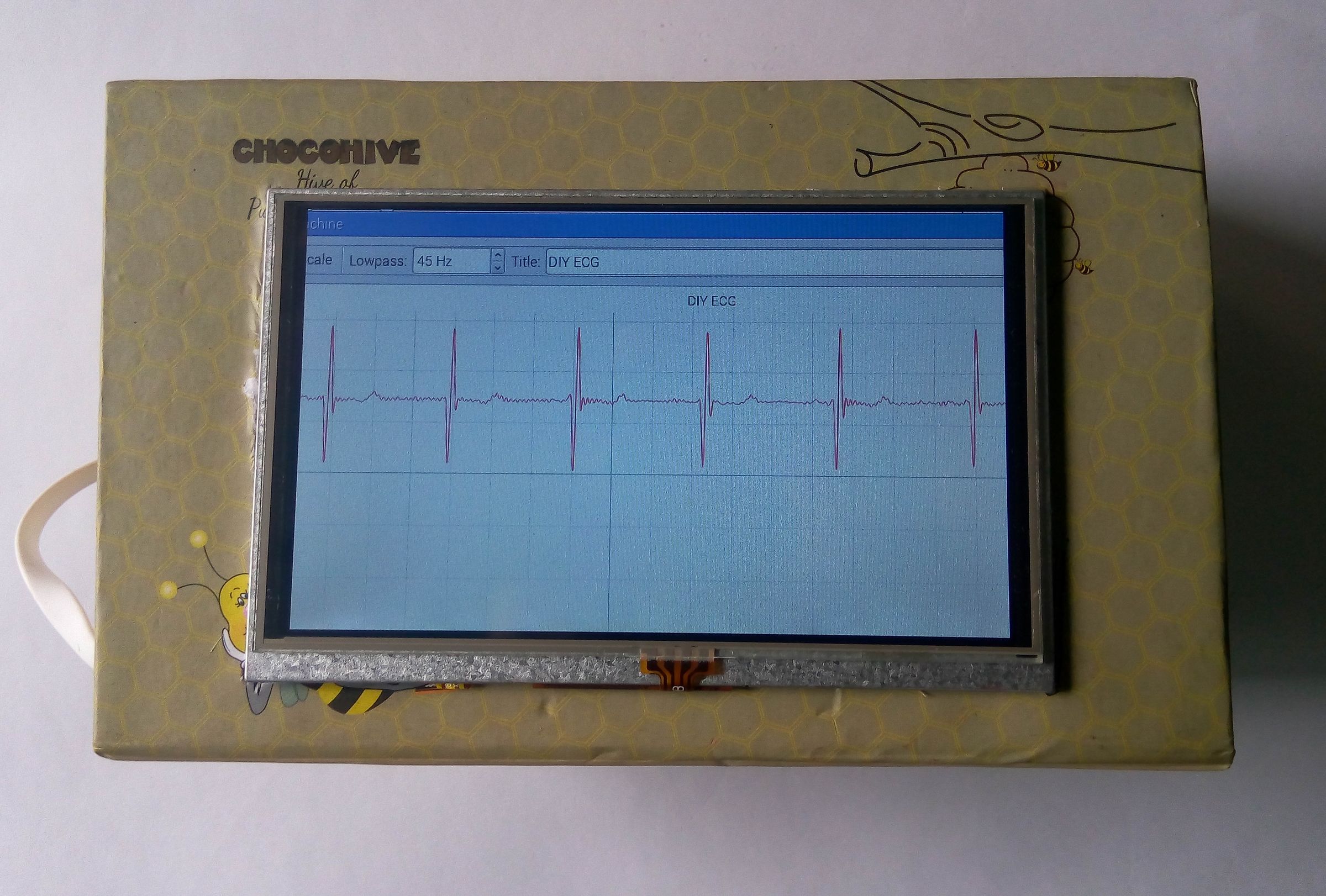 Portable ECG Machine : 9 Steps (with Pictures) - Instructables