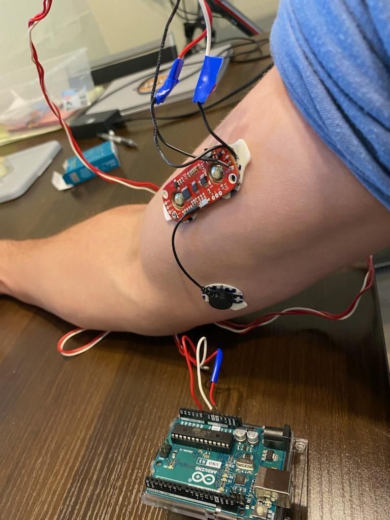 Electromyography With MyoWare Muscle Sensor Arduino, 54% OFF