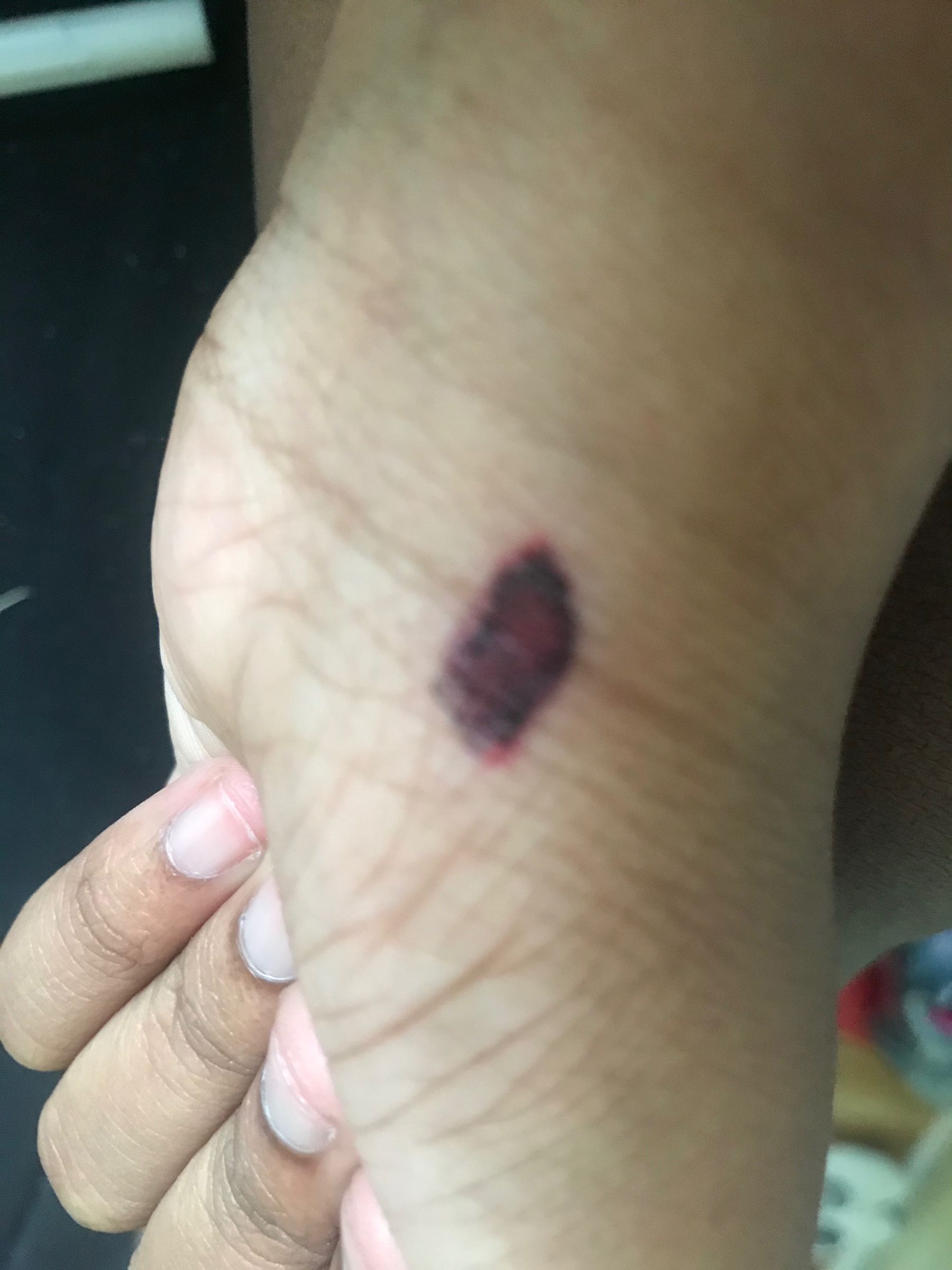 How to Create a Fake Bruise : 6 Steps - Instructables