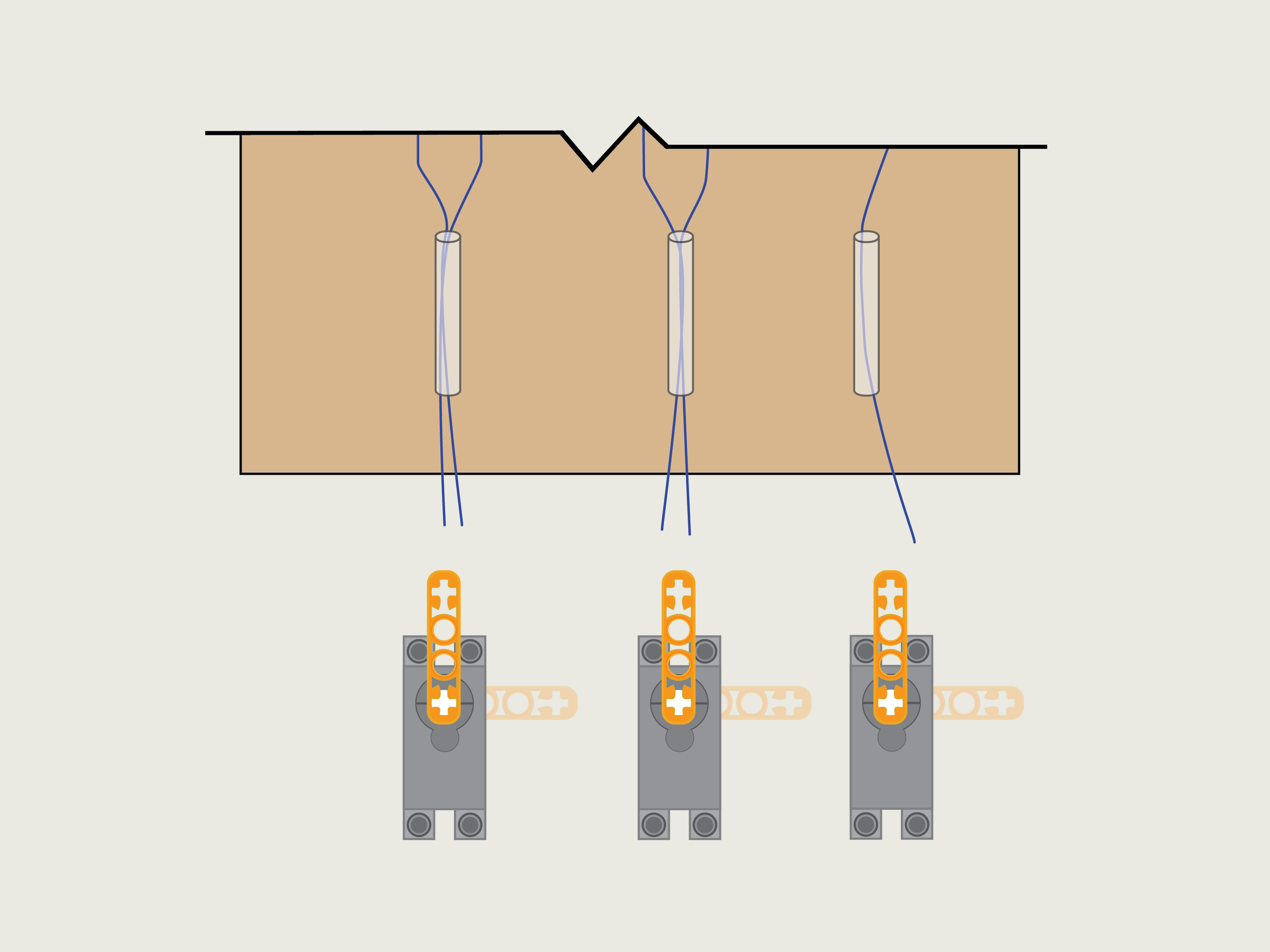 Robotic Hand With Micro:bit : 22 Steps (with Pictures) - Instructables