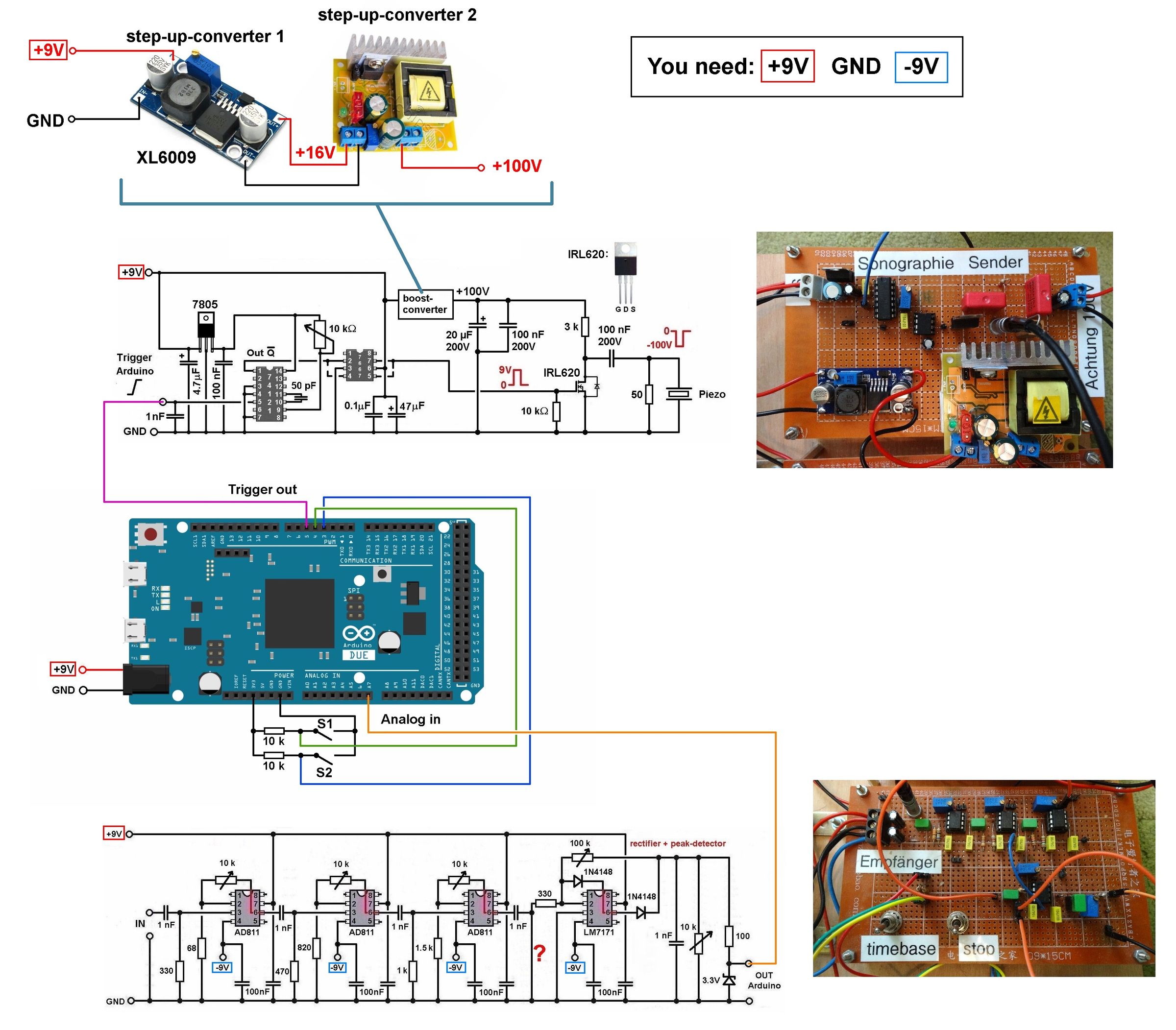Body-ultrasound Sonography With Arduino : 3 Steps (with Pictures) - Instructables