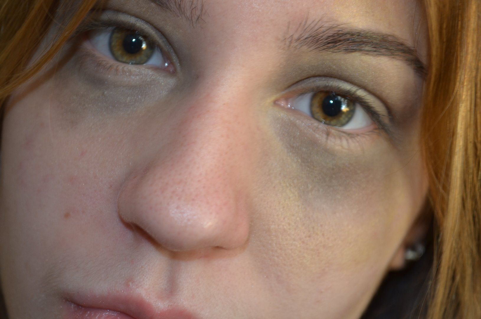 How to Make a Bruise : 7 Steps (with Pictures) - Instructables