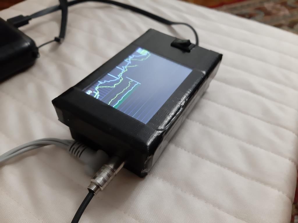 ECG With PPG Using Arduino : 9 Steps (with Pictures) - Instructables