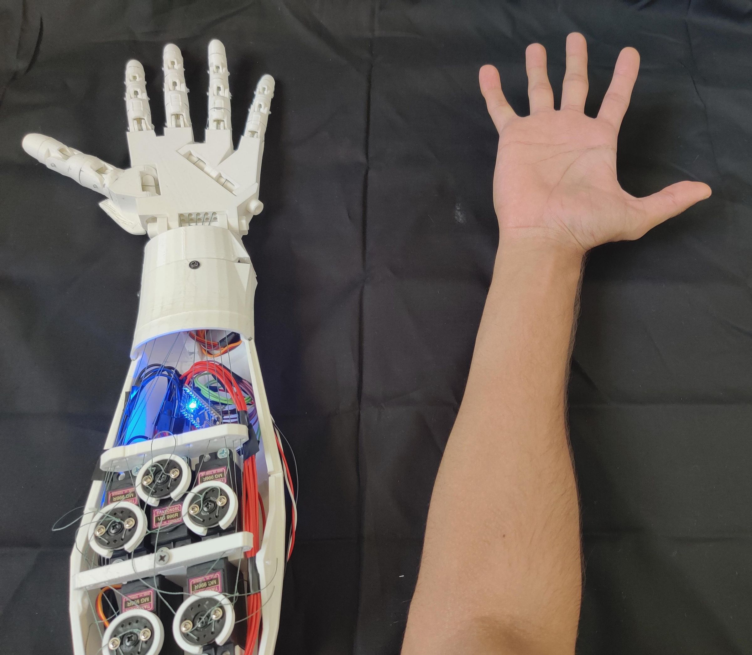 3D Printed EMG Prosthetic Hand : 5 Steps (with Pictures) - Instructables