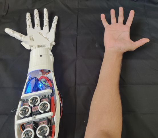 3D Printed EMG Prosthetic Hand : 5 Steps (with Pictures) - Instructables