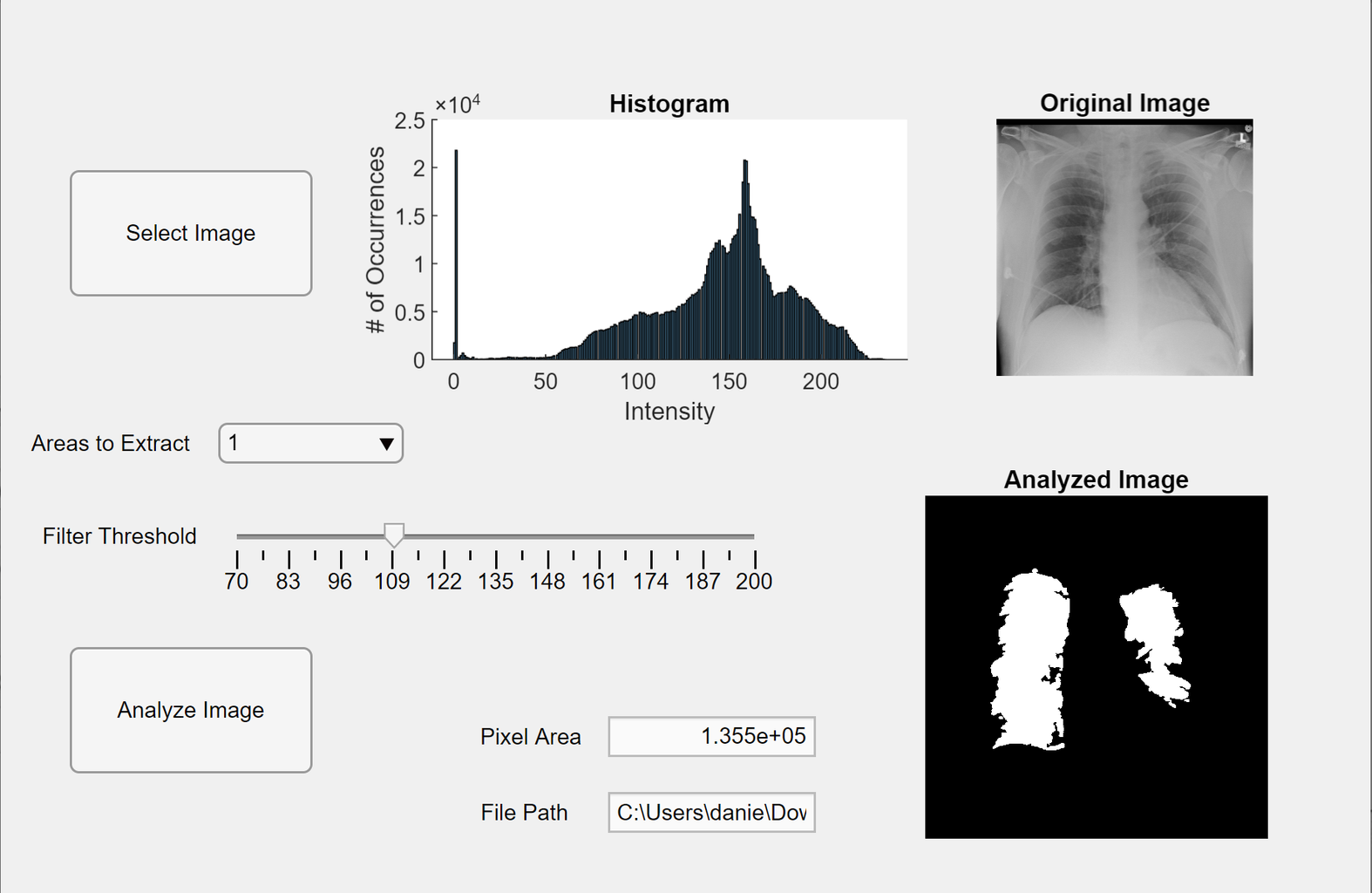 MatLab Lung Segmentation : 5 Steps - Instructables MatLab Lung Segmentation : 5 Steps - Instructables