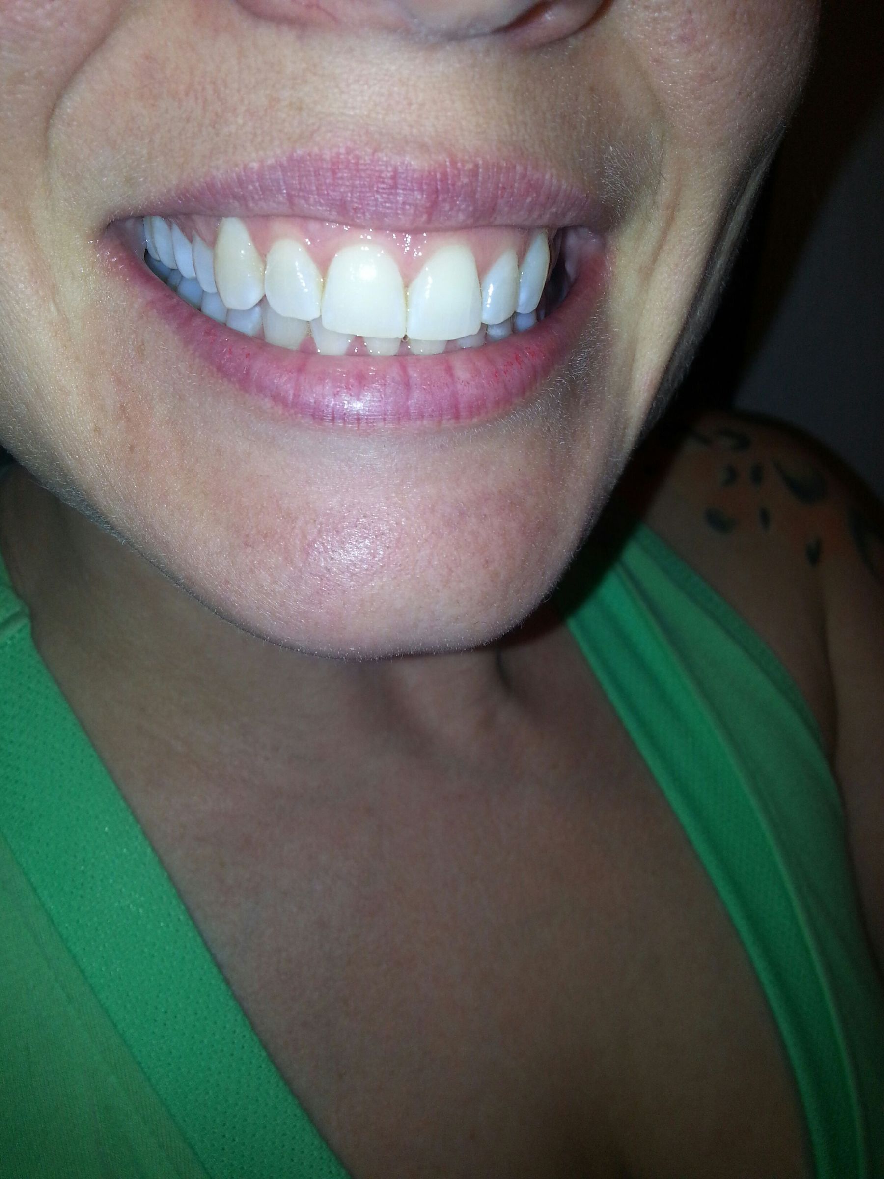 Easy Homemade Toothpaste : 4 Steps (with Pictures) - Instructables