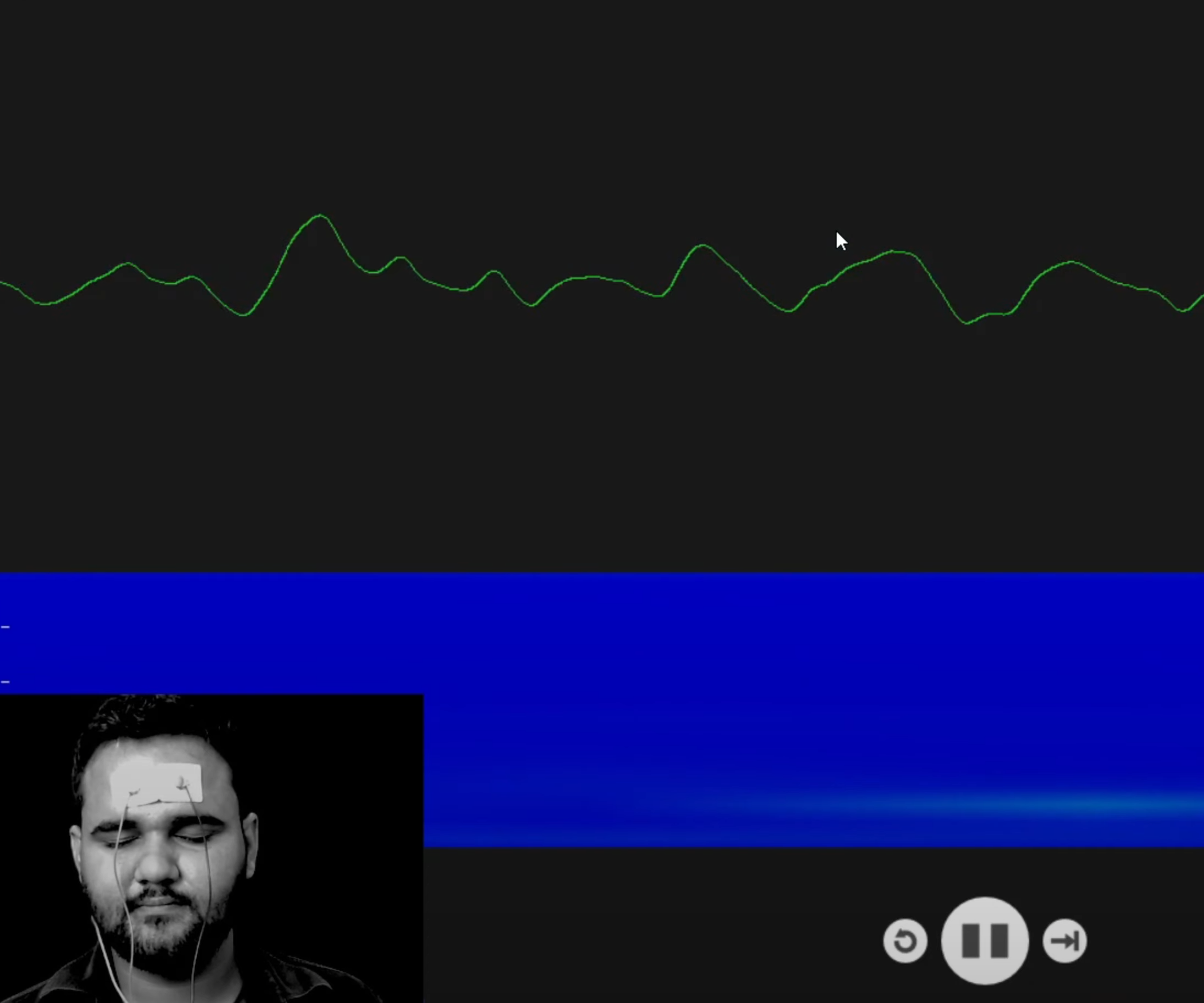 Recording EEG From Pre Frontal Cortex of Brain Using BioAmp EXG Pill ...