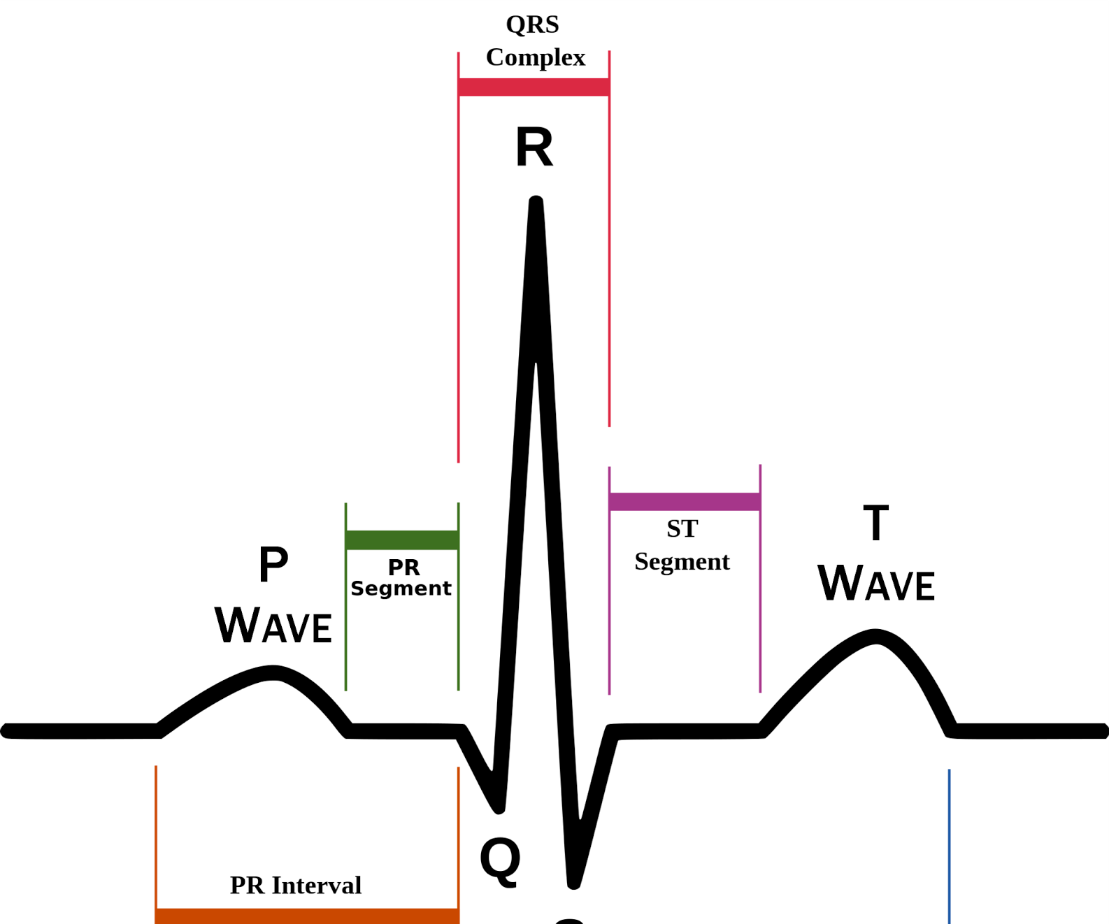 ECG Monitor : 8 Steps - Instructables