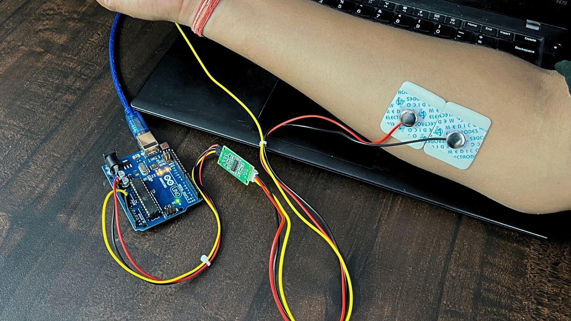 Measuring Muscle Signals Using Candy Size Muscle Sensor (EMG) : 8 Steps ...