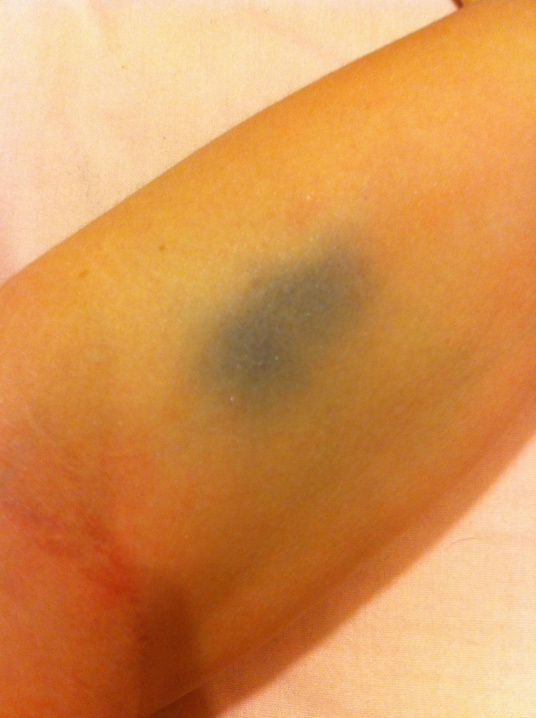 How to Create a Fake Bruise : 6 Steps - Instructables