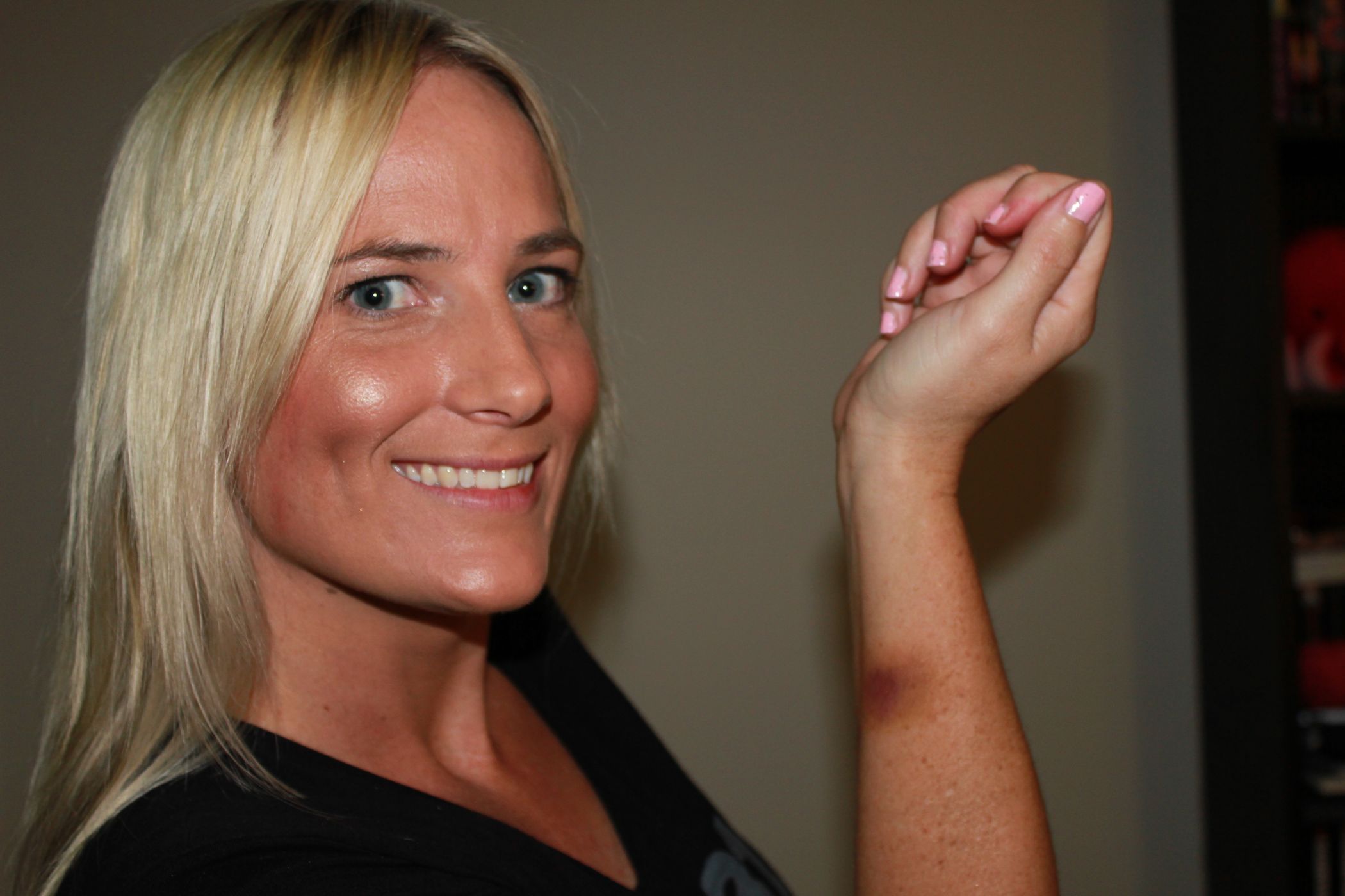 How to Make a Bruise, Scratches and Cuts With Makeup! - Instructables