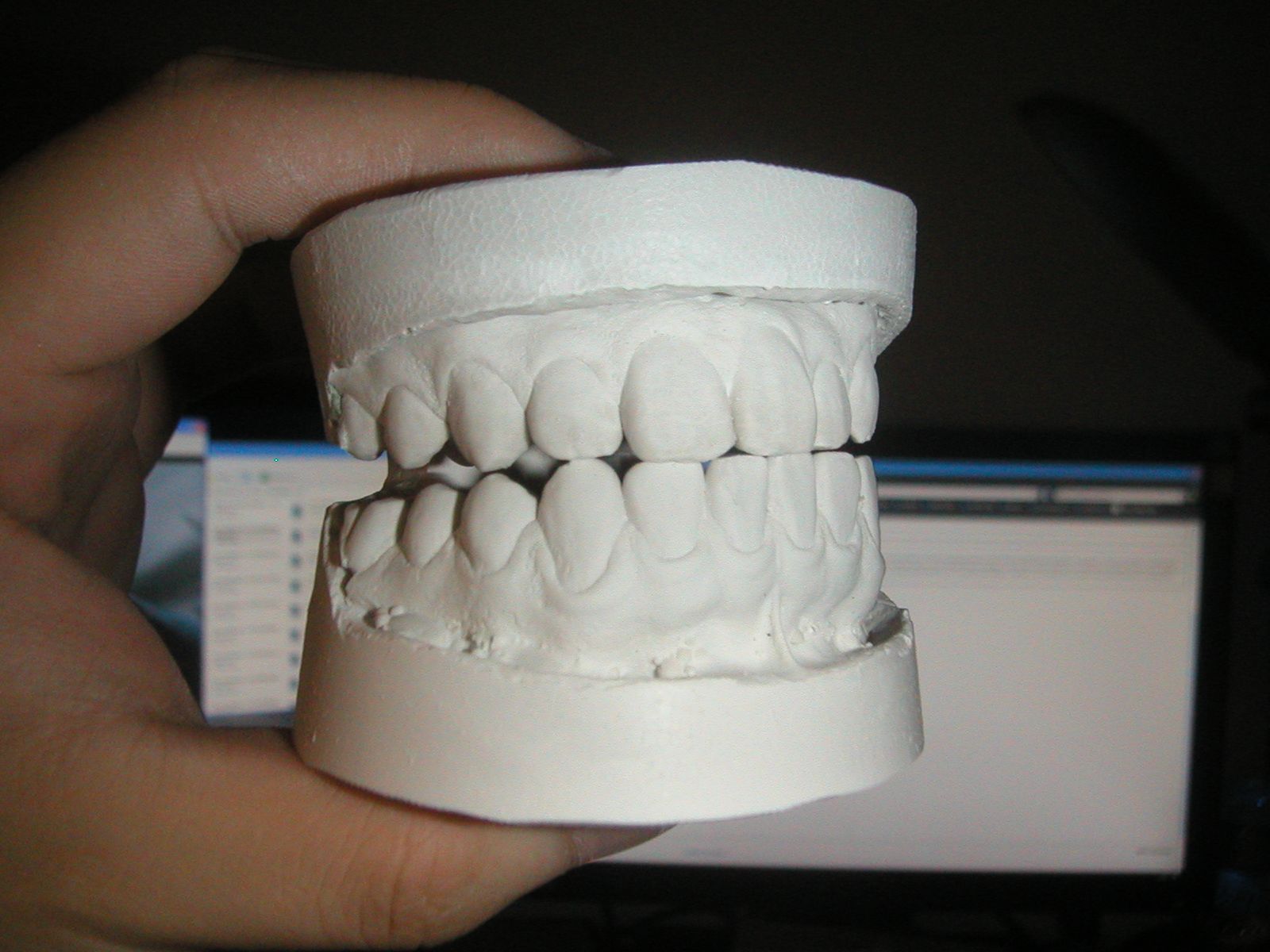 Make Teeth Mold for Halloween Teeth : 4 Steps (with Pictures ...