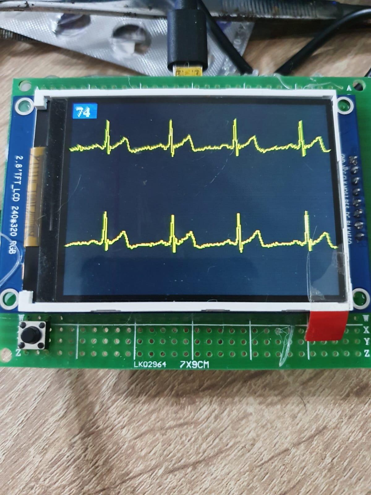 ECG Display With Arduino : 13 Steps (with Pictures) - Instructables