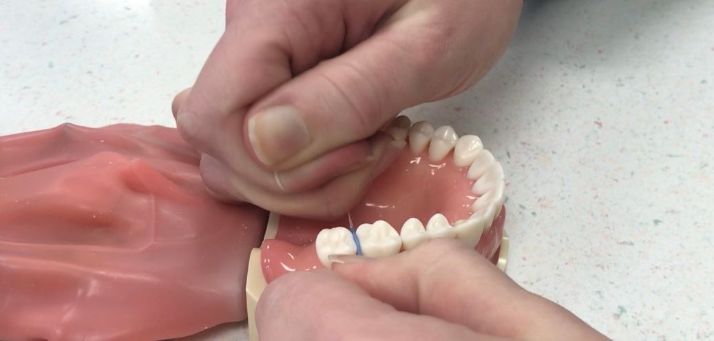 Placing & Removing Elastic Spacers : 5 Steps - Instructables