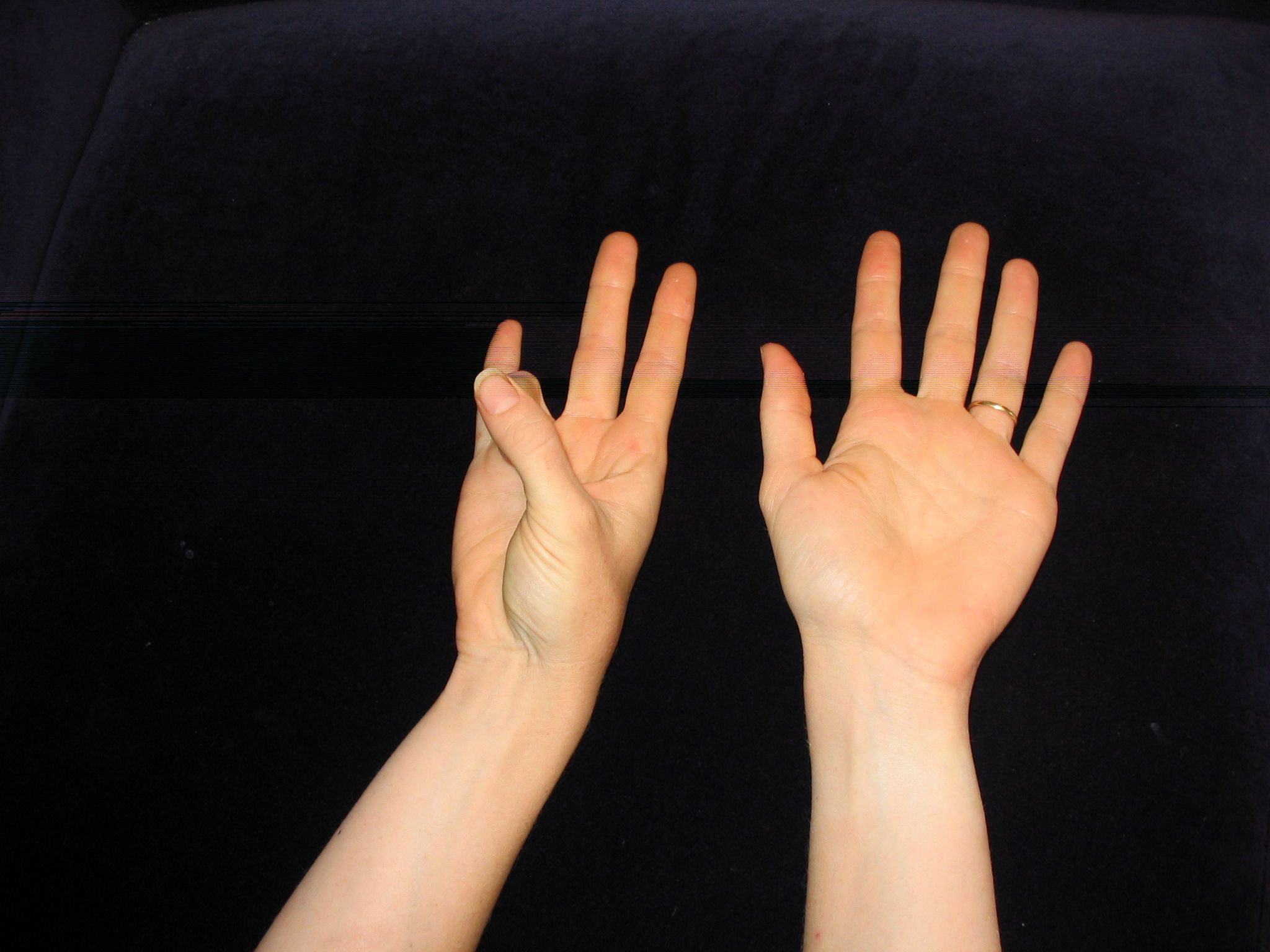 Mouse Toe Numbering Scheme : 5 Steps - Instructables