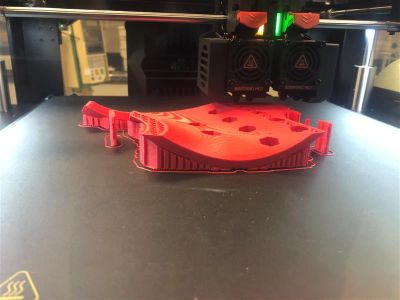3D Printed Back Brace for Scoliosis : 7 Steps (with Pictures ...
