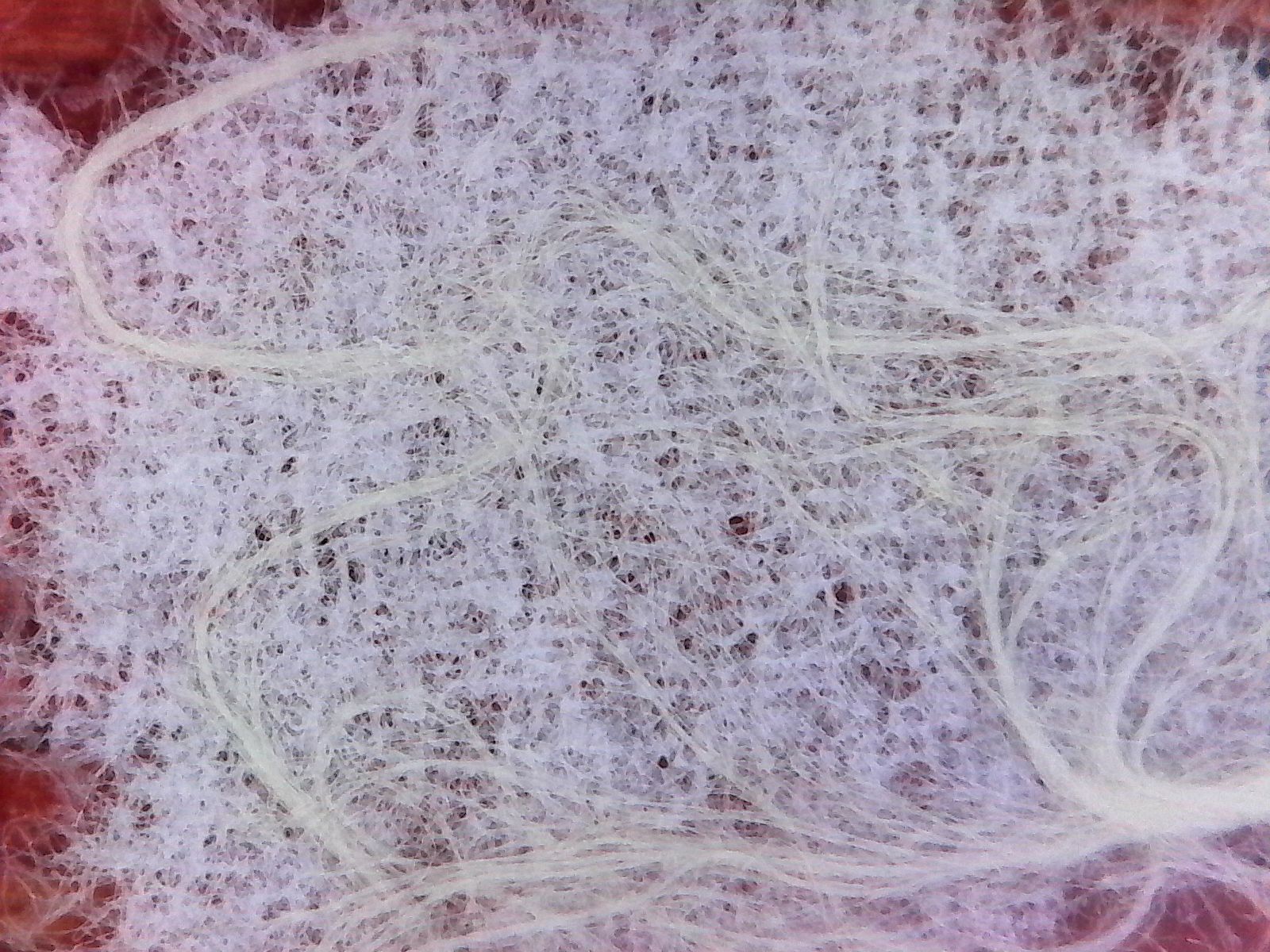 Low-cost Fluorescence and Brightfield Microscopes : 9 Steps (with ...
