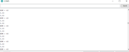 Building an ECG With Breadboard Components and Arduino : 11 Steps ...