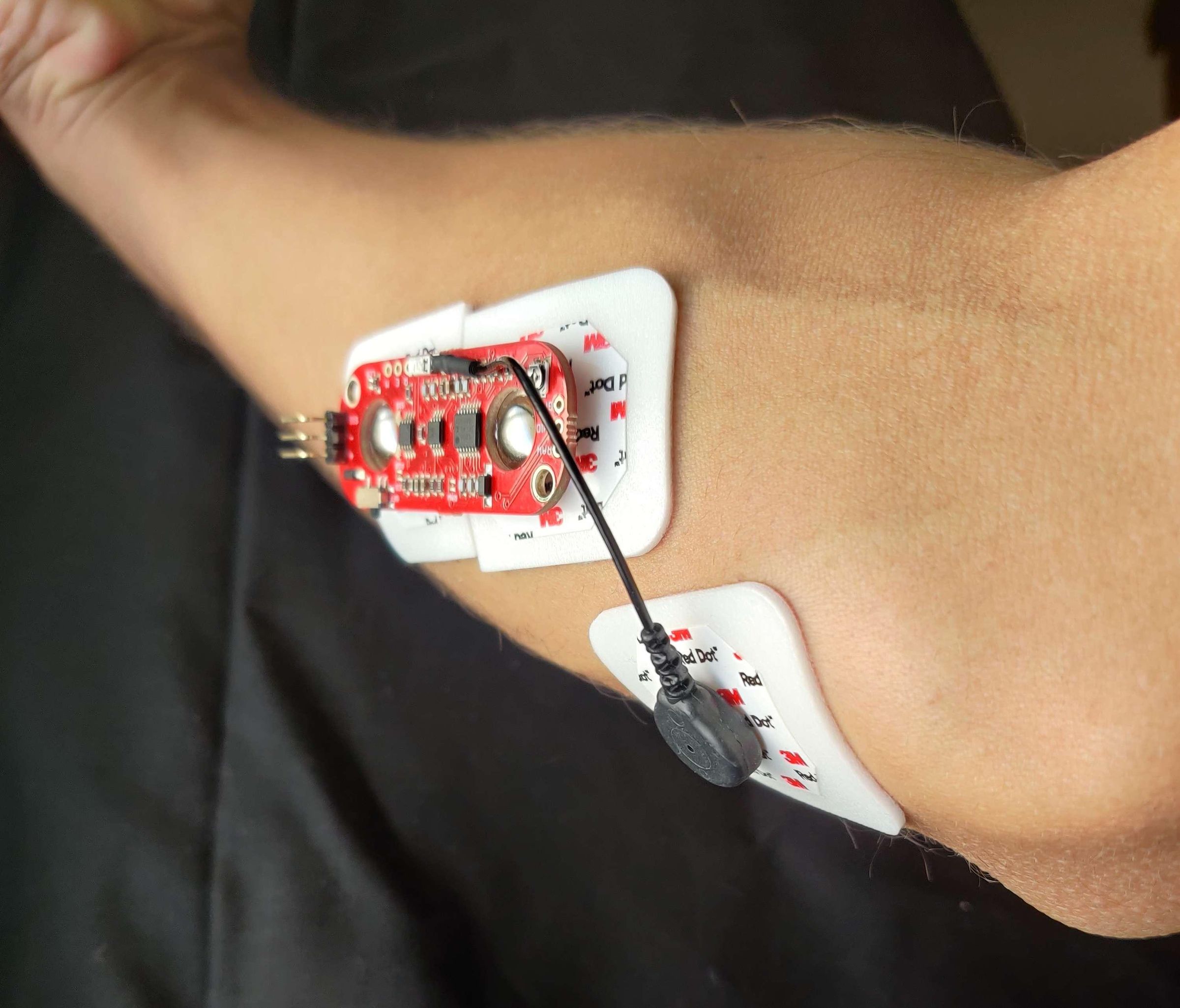 3D Printed EMG Prosthetic Hand : 5 Steps (with Pictures) - Instructables