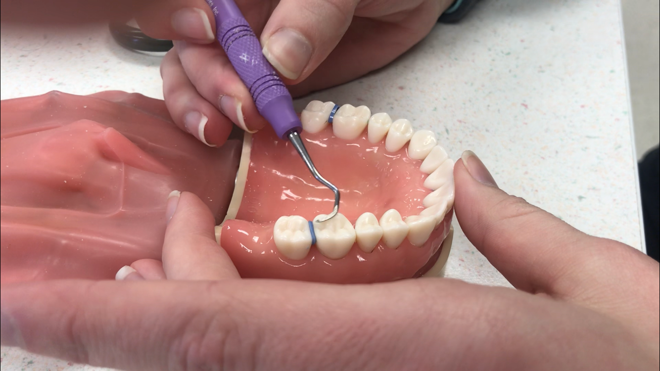 Placing & Removing Elastic Spacers : 5 Steps - Instructables