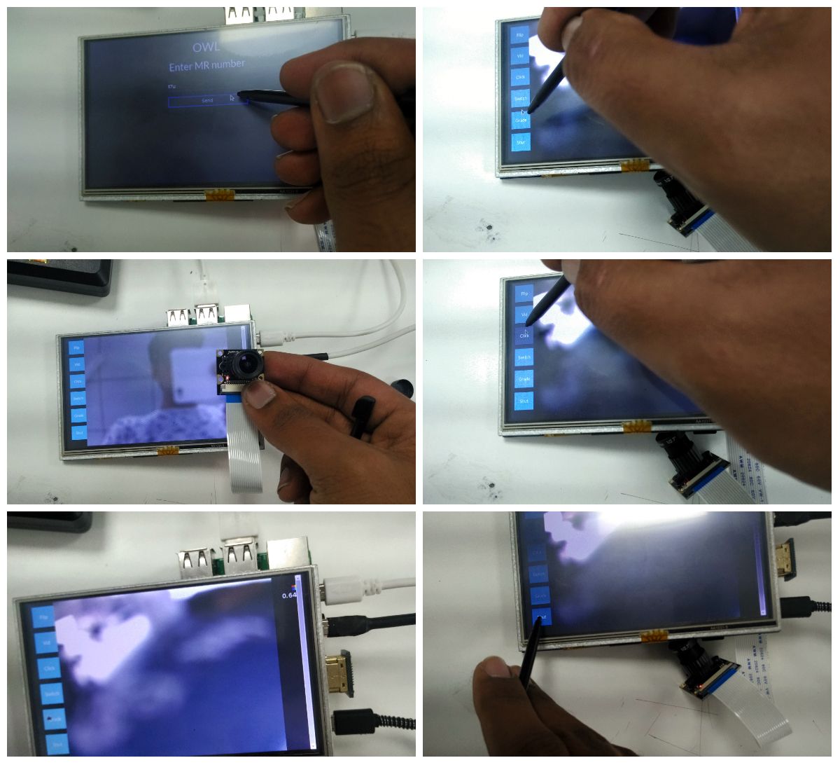 Open Indirect Ophthalmoscope (OIO) : 10 Steps (with Pictures ...