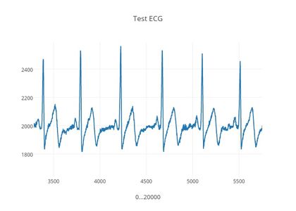 ECG Using Intel Edison and Plotly : 6 Steps - Instructables