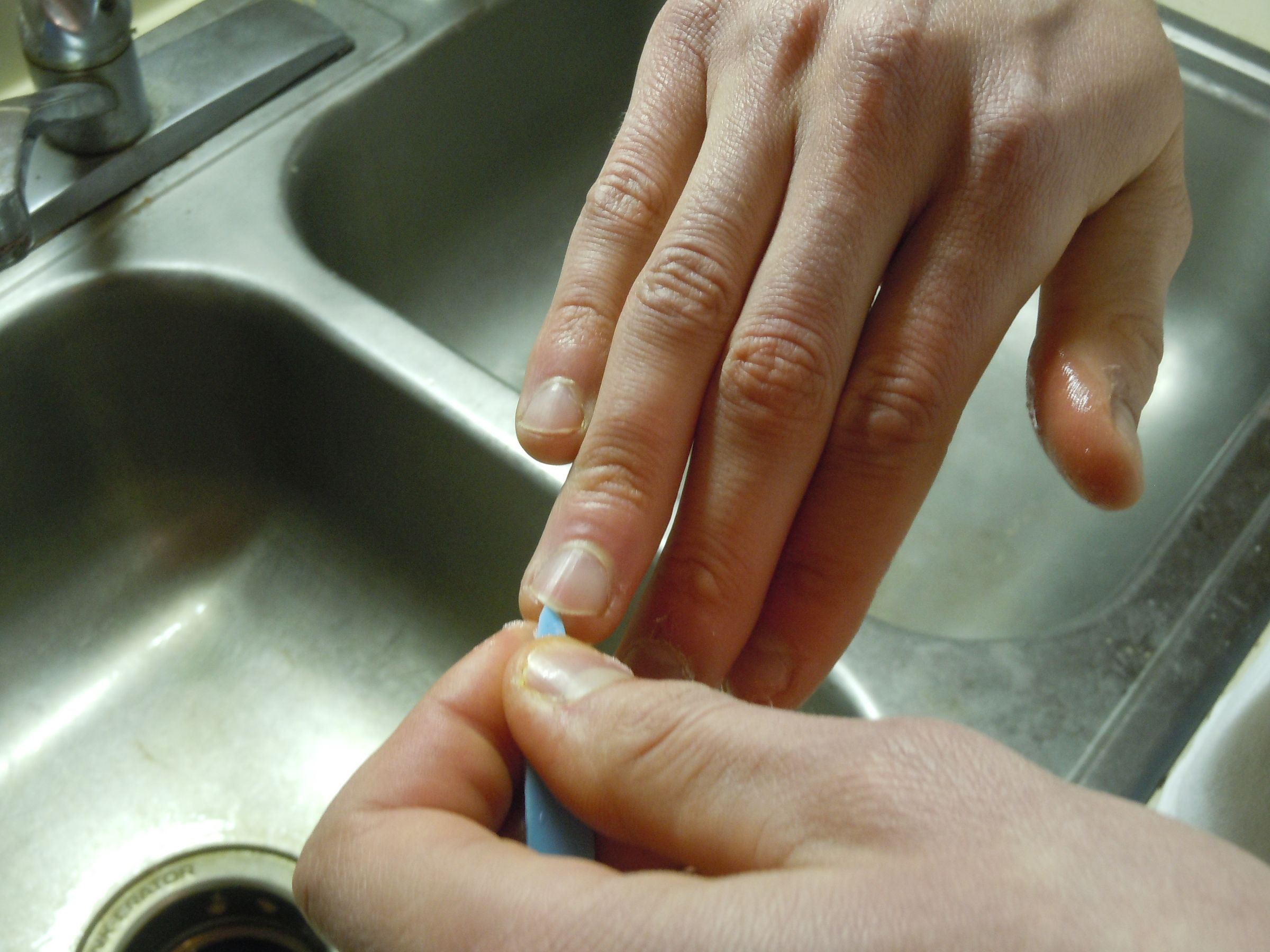 Sterile Surgical Scrub--Scrub Like a Surgeon! : 14 Steps (with Pictures ...