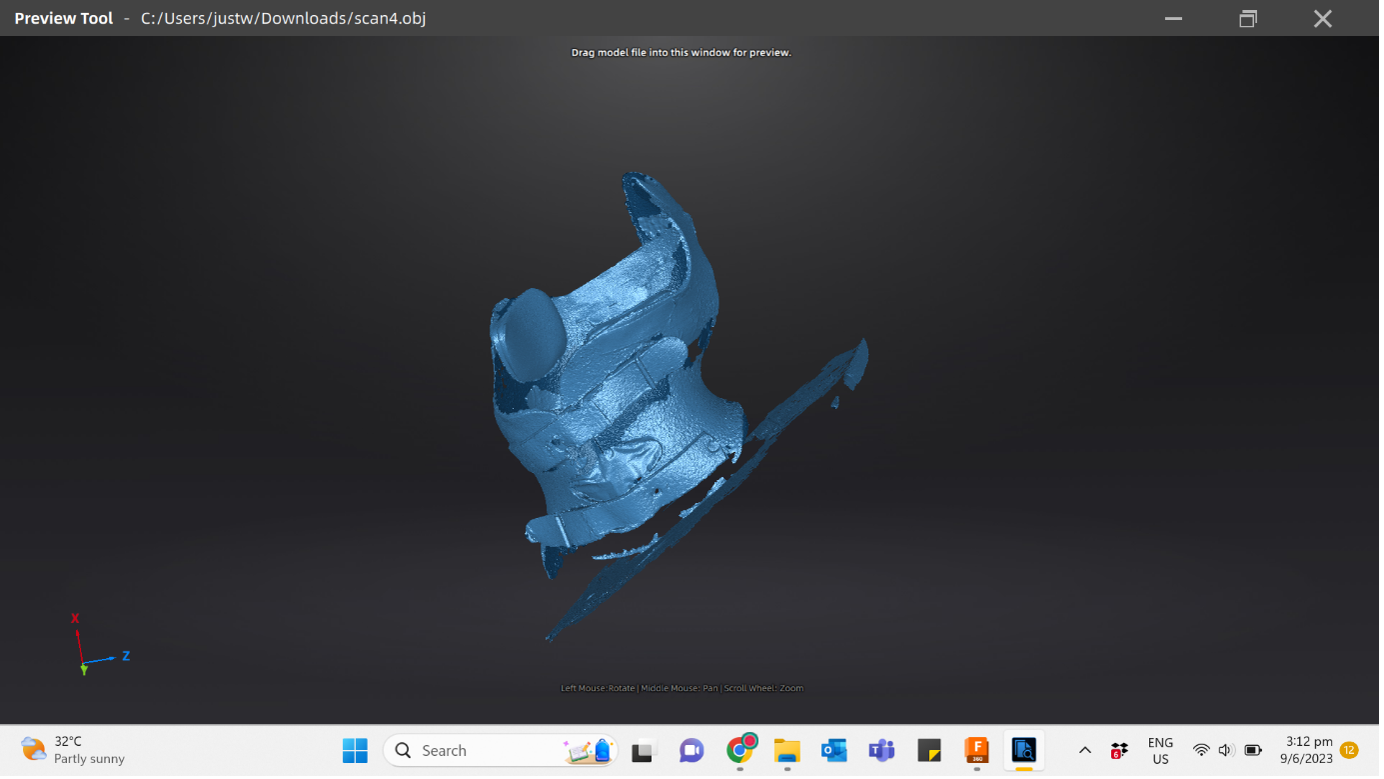 3D Printed Back Brace for Scoliosis : 7 Steps (with Pictures ...
