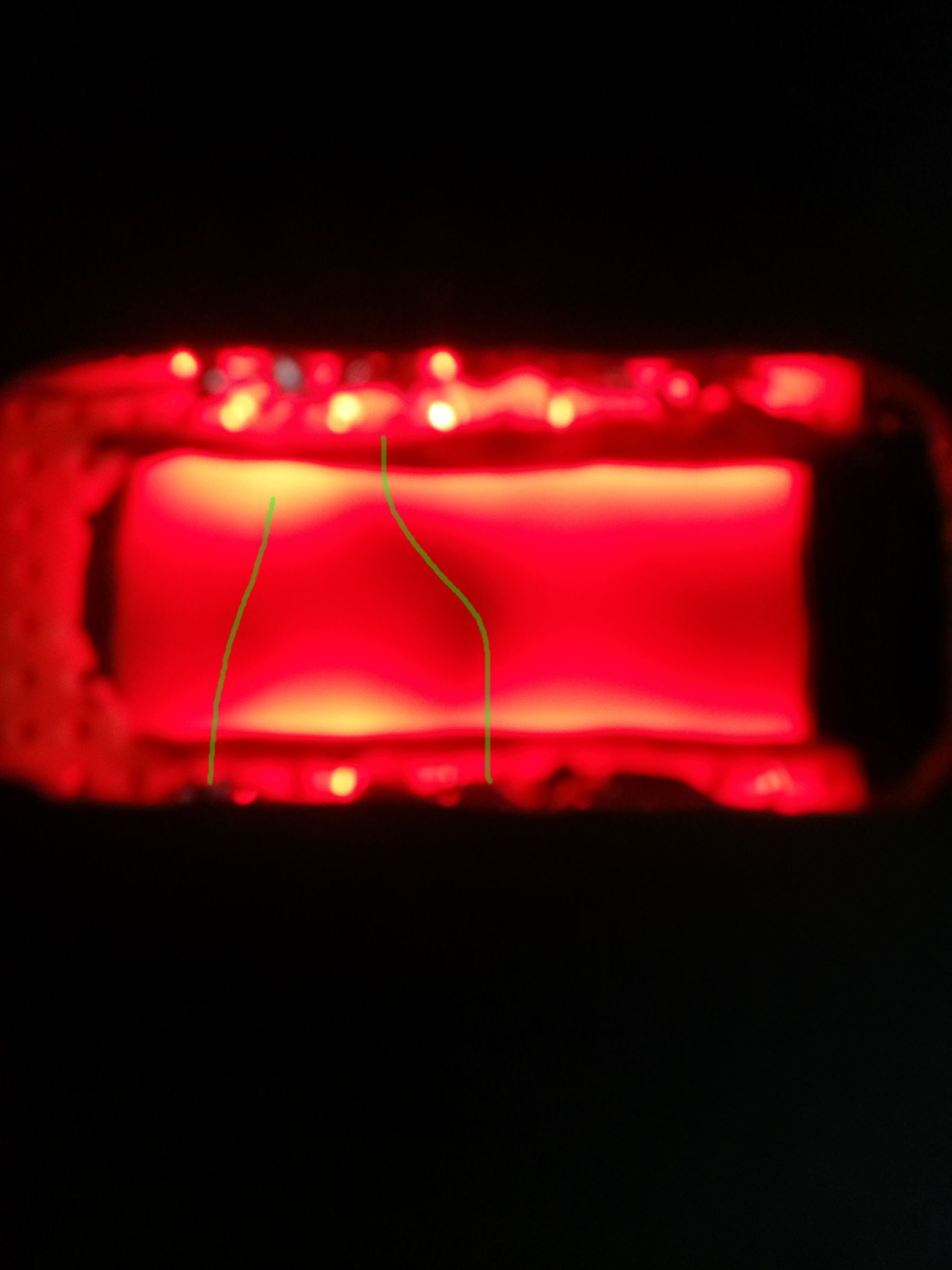 How to Make an Affordable 'Vein Finder', for Use During Venipuncture ...