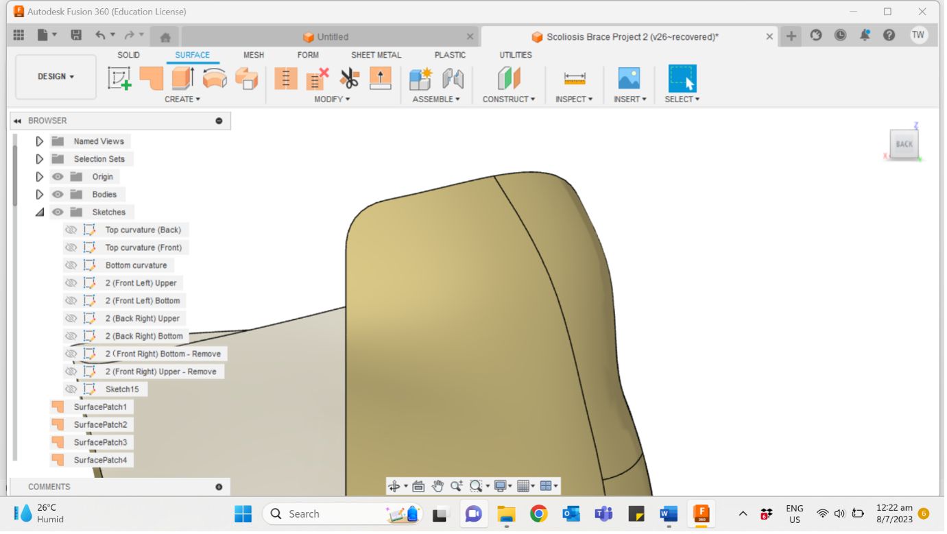 3D Printed Back Brace for Scoliosis : 7 Steps (with Pictures ...