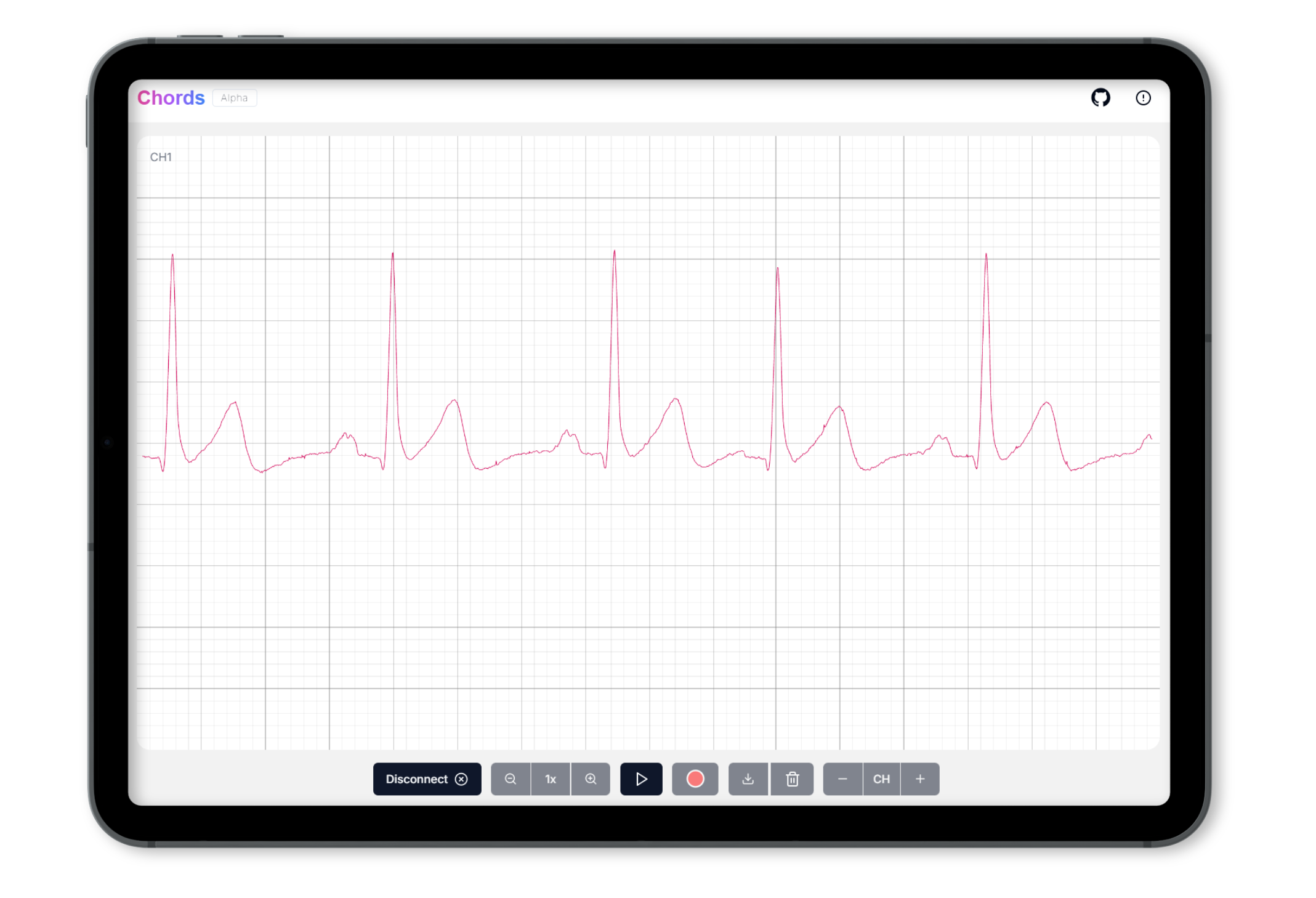 Recording ECG Signals Using Heart BioAmp Candy : 7 Steps - Instructables