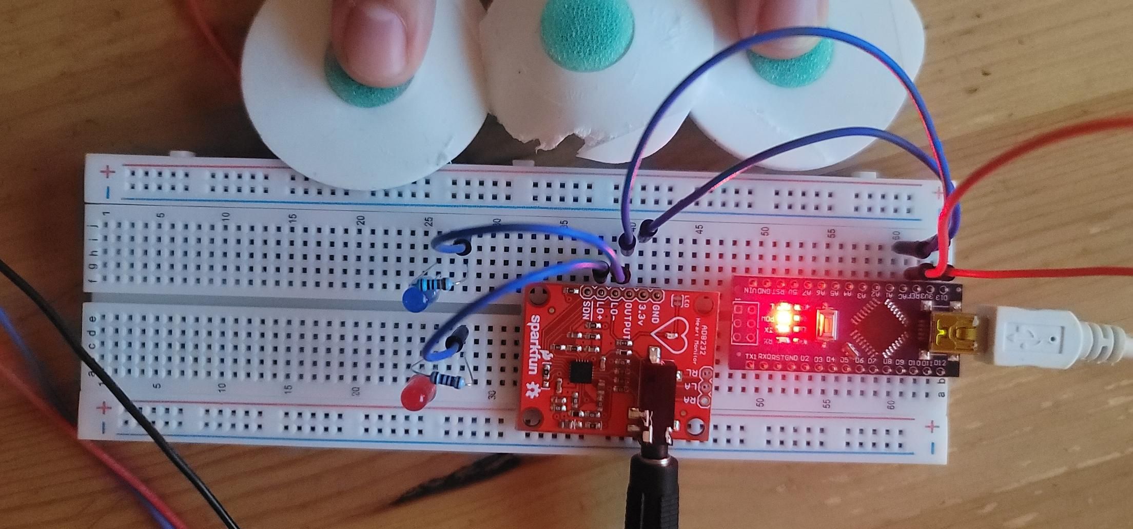 ECG Display With Arduino : 13 Steps (with Pictures) - Instructables